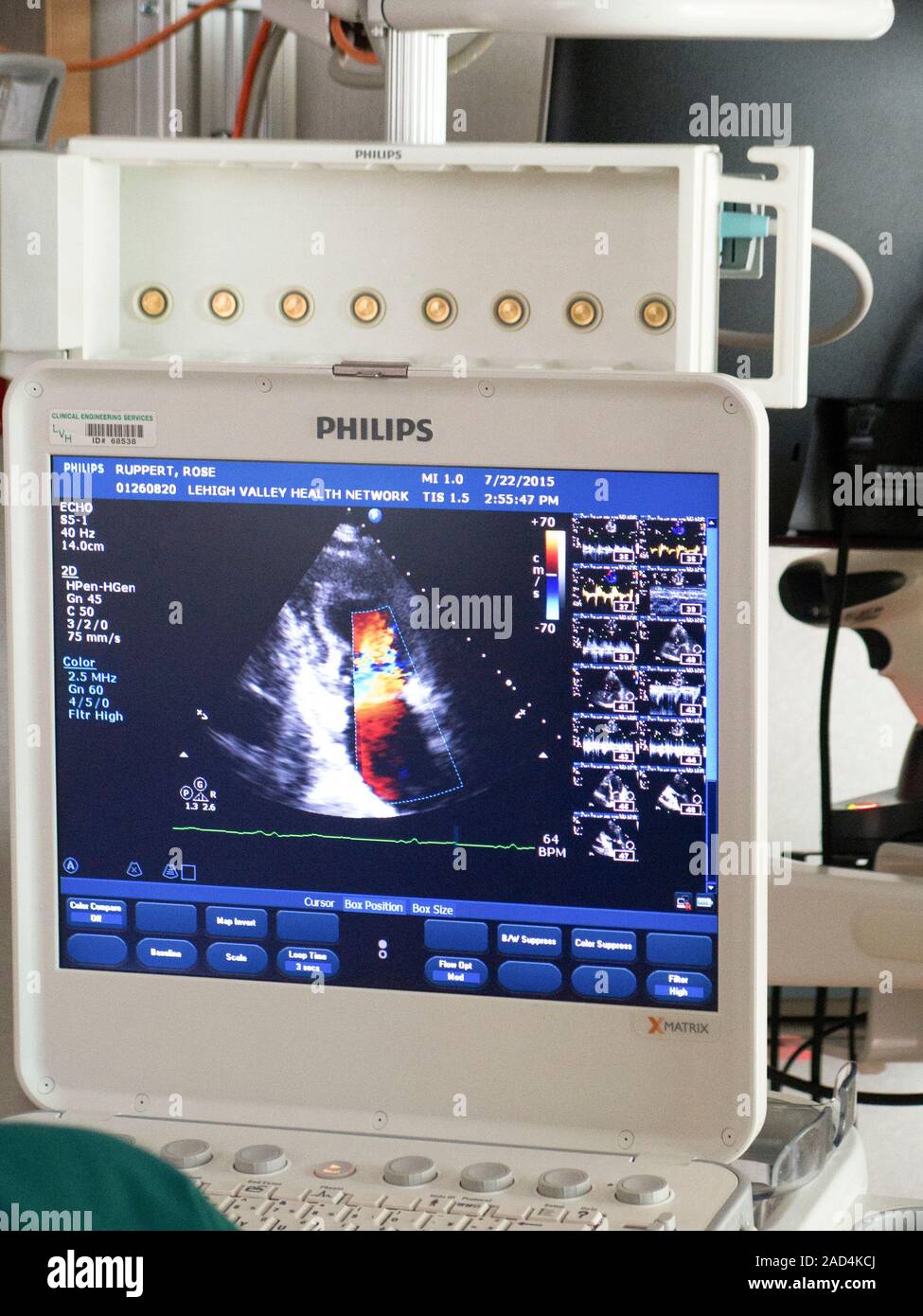 Cardiac ultrasound scanner. Two-dimensional echocardiography being ...
