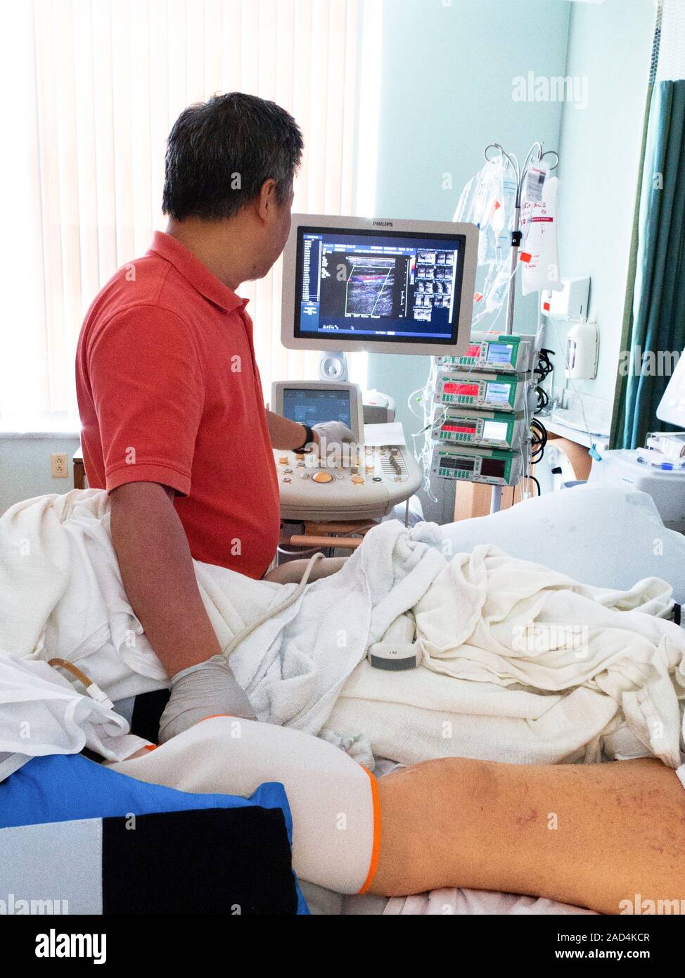 Deep vein thrombosis ultrasound testing. Medical worker performing a ...