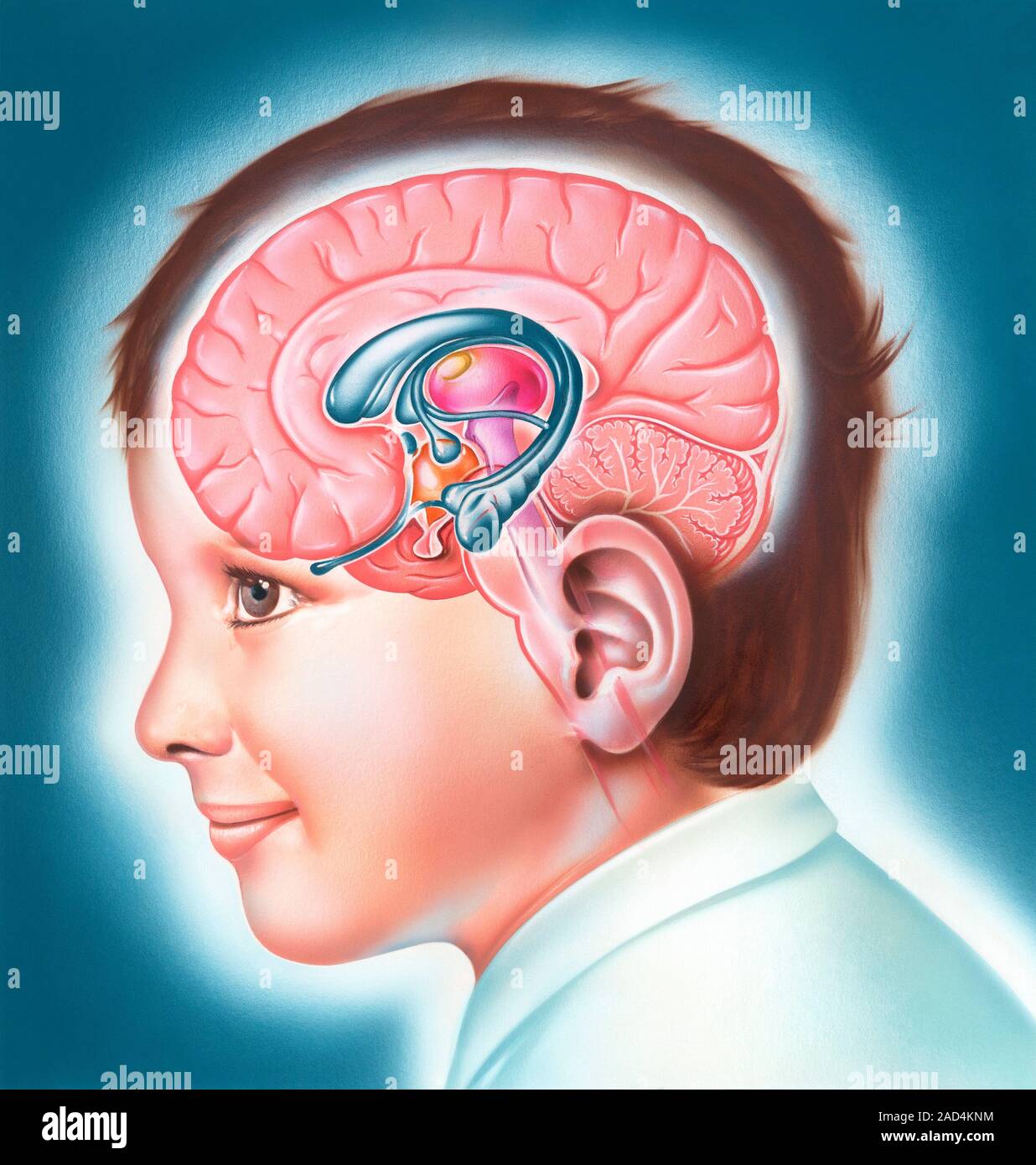 Child's limbic system. Illustration of a child's brain seen from the ...