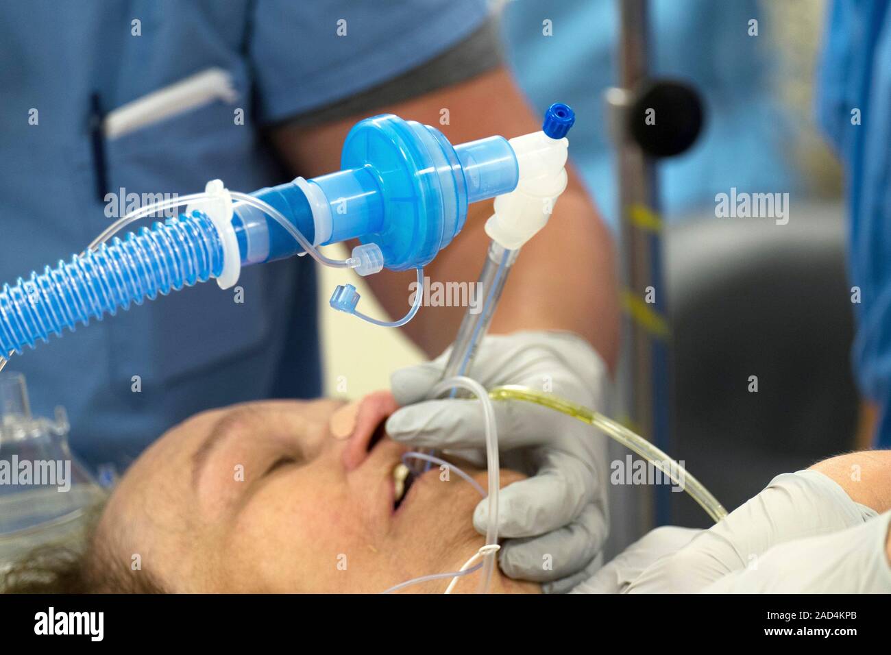 General anaesthesia ventilation. Nurse anaesthetist (CRNA) connecting ...