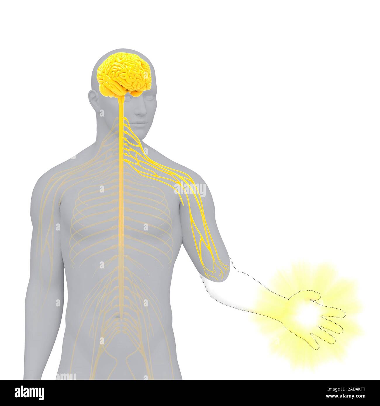 Phantom pain, conceptual image. Computer illustration representing a ...
