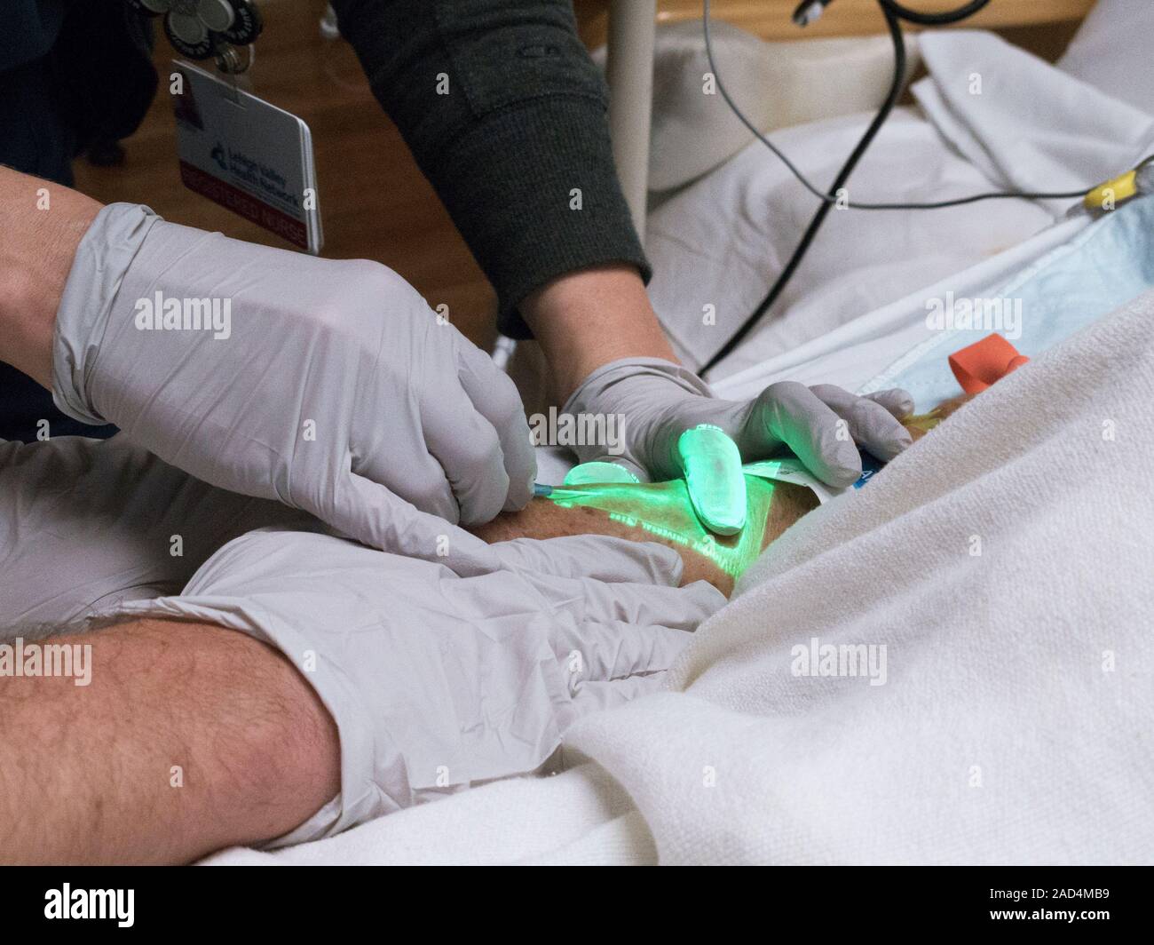Nurse using infrared vein-finding device. Close-up of a nurse using an ...