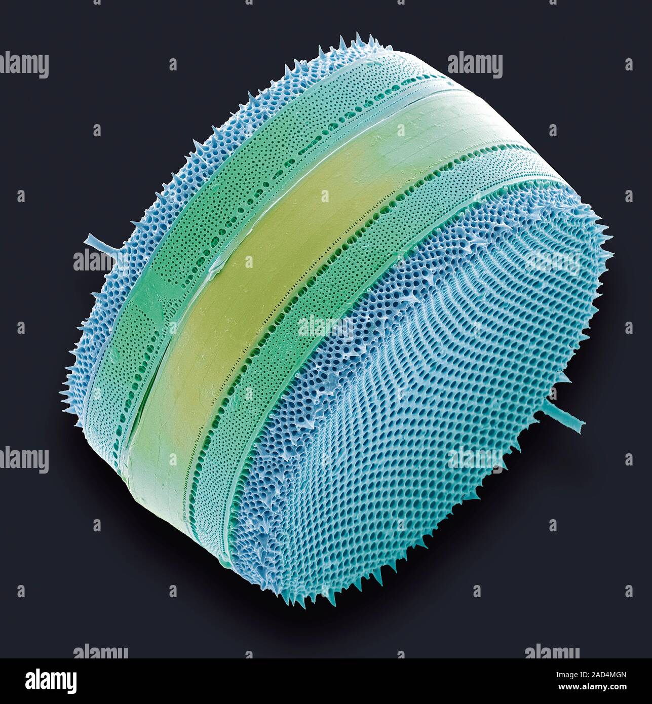 Diatom. Coloured scanning electron micrograph (SEM) of a single diatom ...