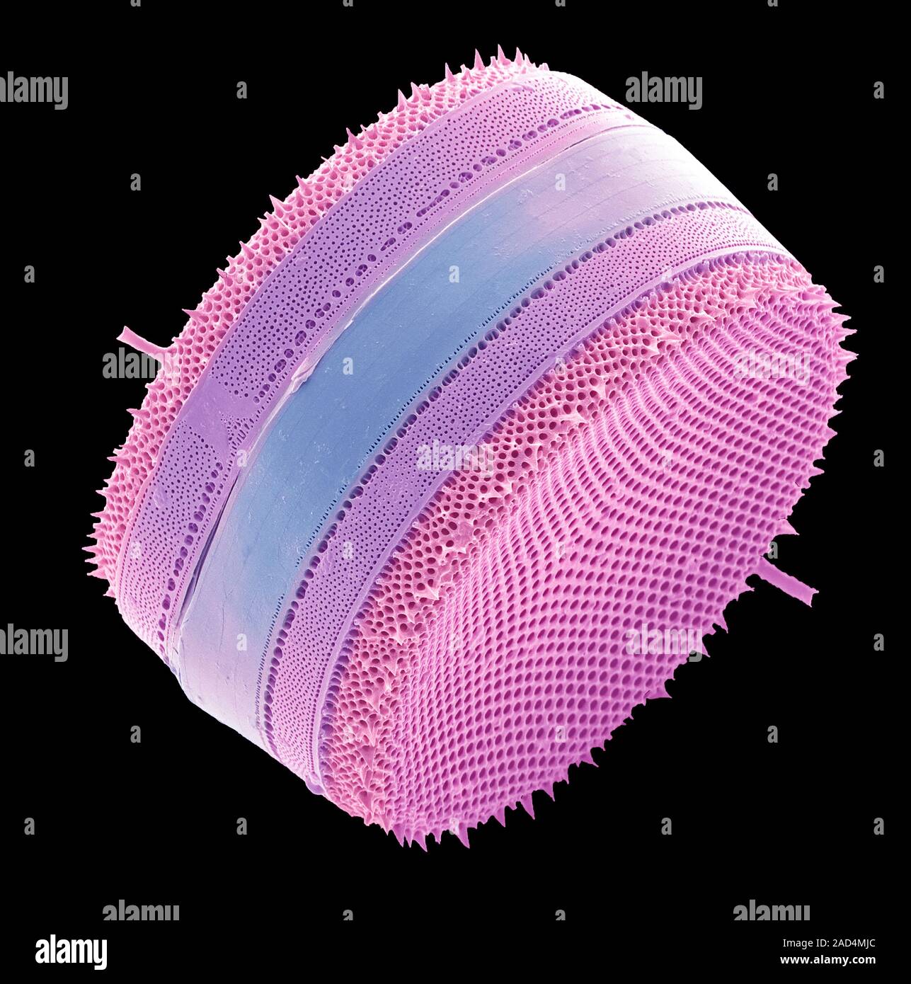 Diatom. Coloured scanning electron micrograph (SEM) of a single diatom ...