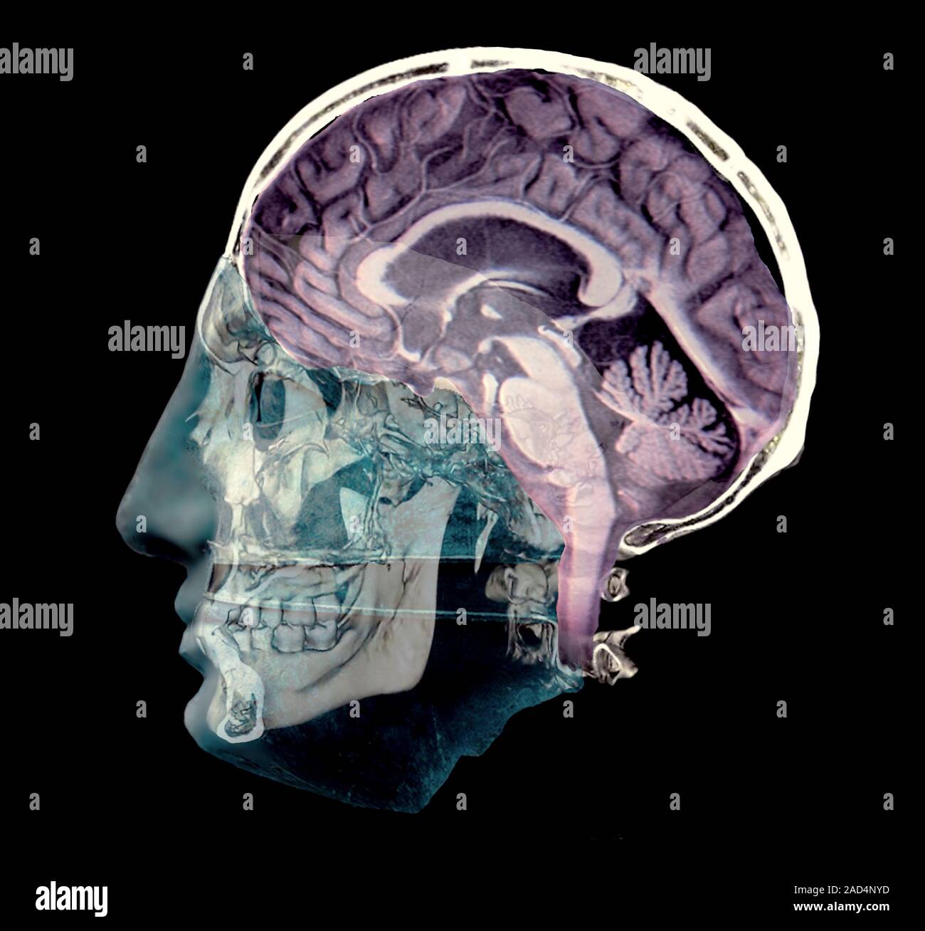 Thought, conceptual 3D MRI and CT image. Computer illustration of ...