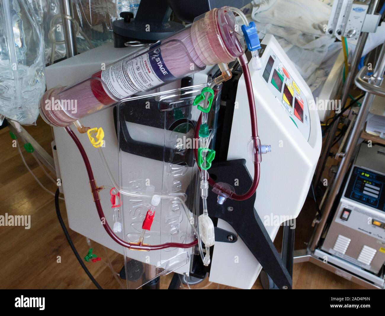 Intensive care renal replacement therapy. Close-up of a haemofilter ...
