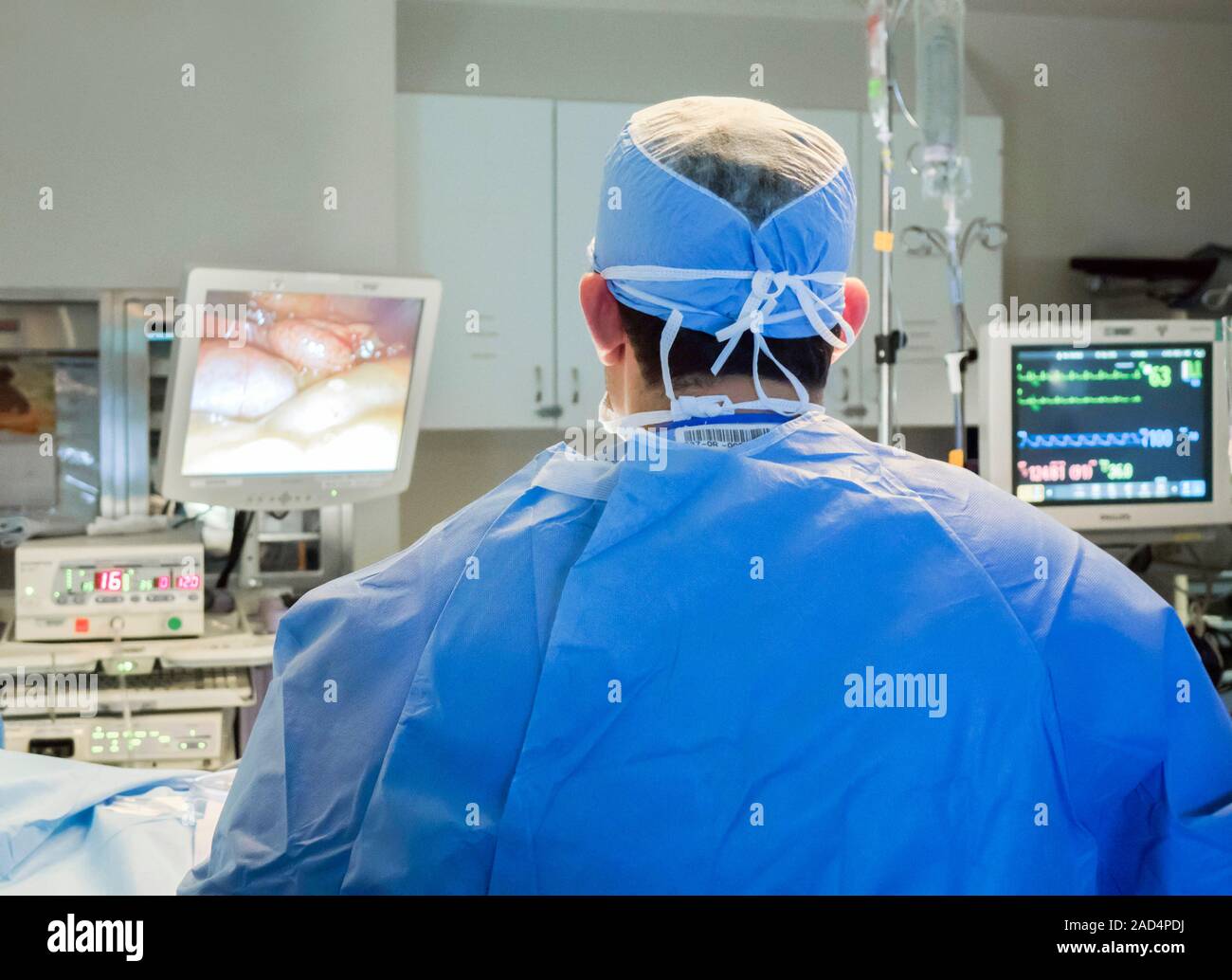 Appendix removal surgery. Surgeon performing a laparoscopic (keyhole ... Appendix removal surgery. Surgeon performing a laparoscopic (keyhole ...