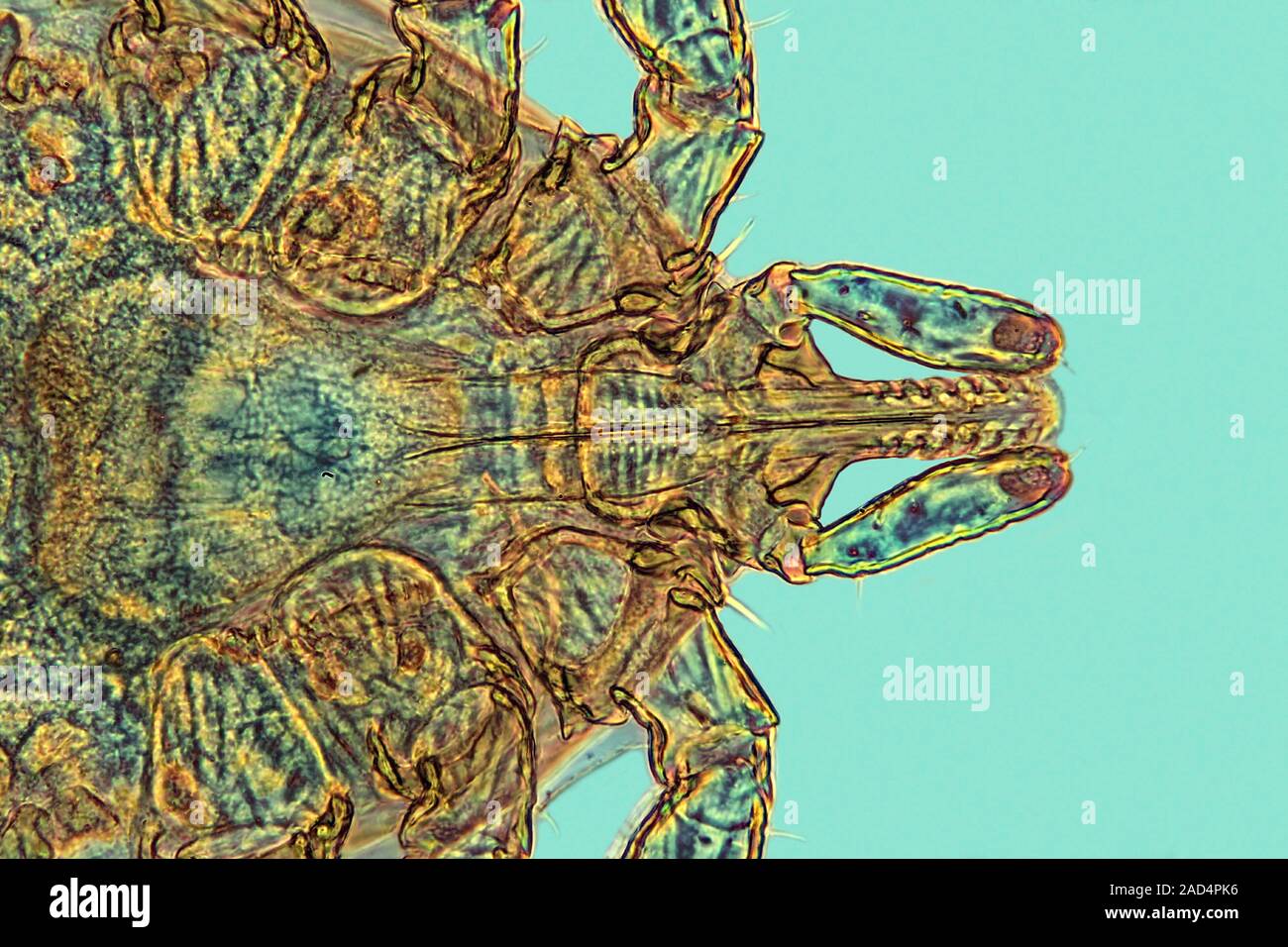 Tick larva. Interphako contrast light micrograph of the head of the ...