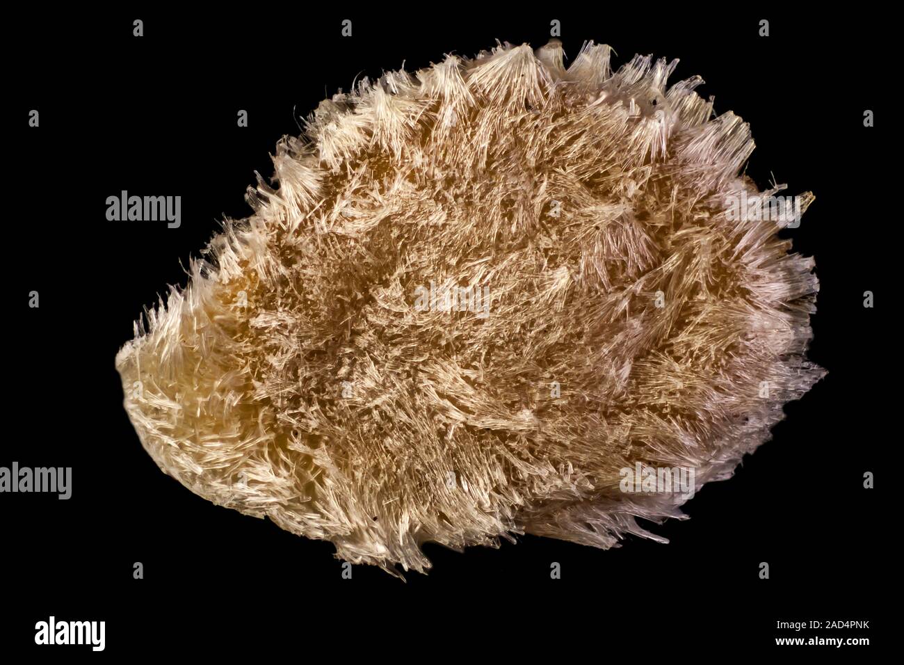 Light micrograph of a seed grain of Solanum lycopersicum, tomato ...