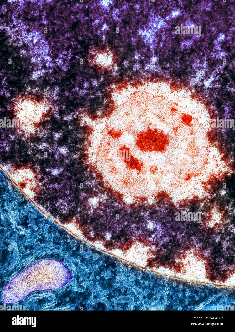 Coloured transmission electron micrograph (TEM) of a section through a ...