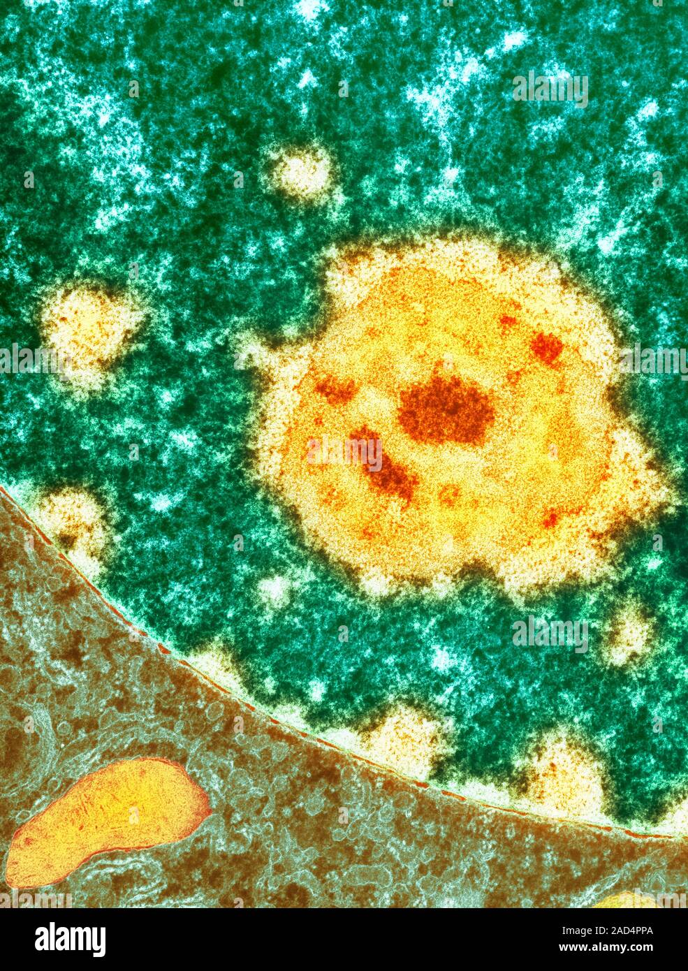 Coloured transmission electron micrograph (TEM) of a section through a ...