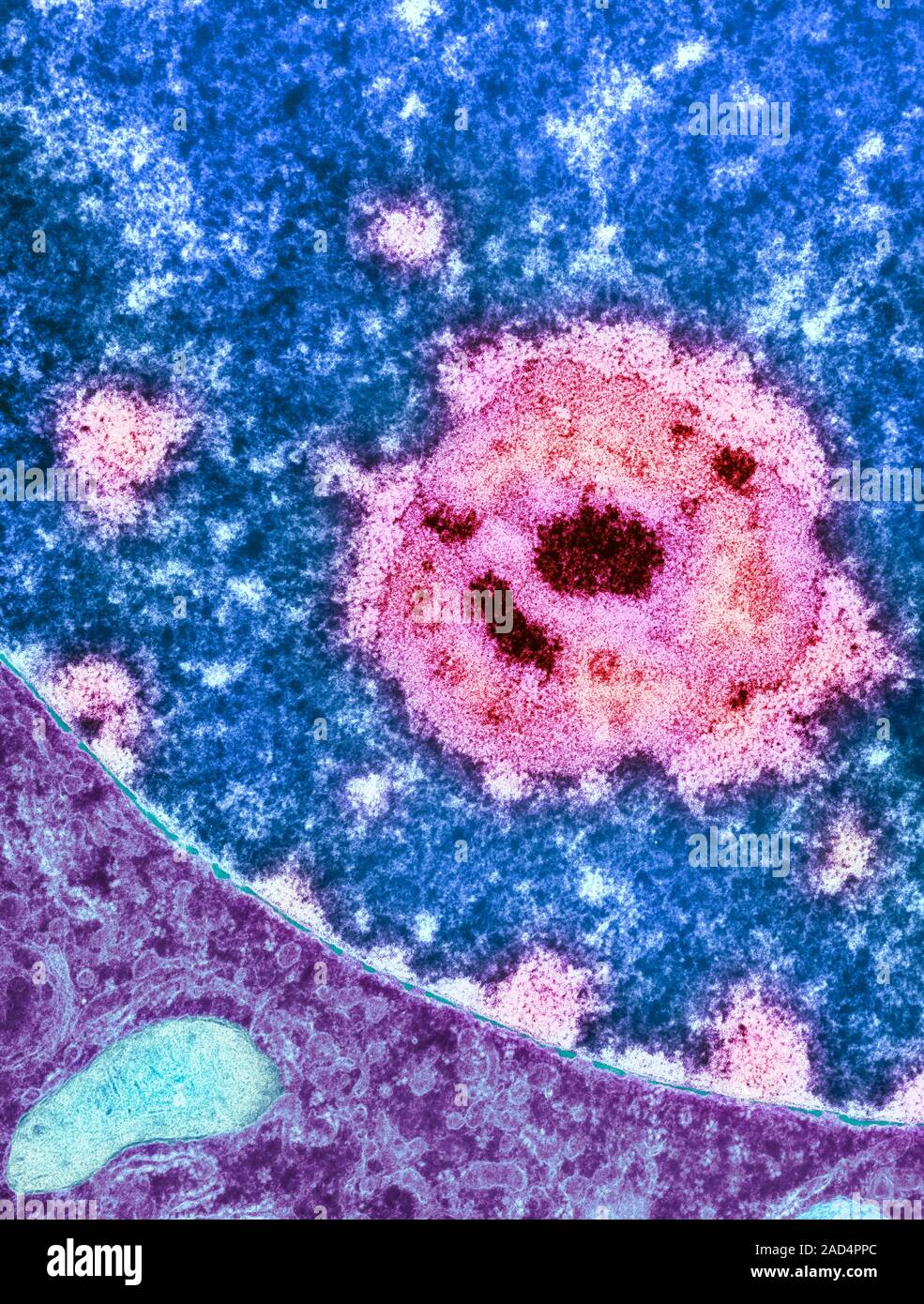 Coloured transmission electron micrograph (TEM) of a section through a ...