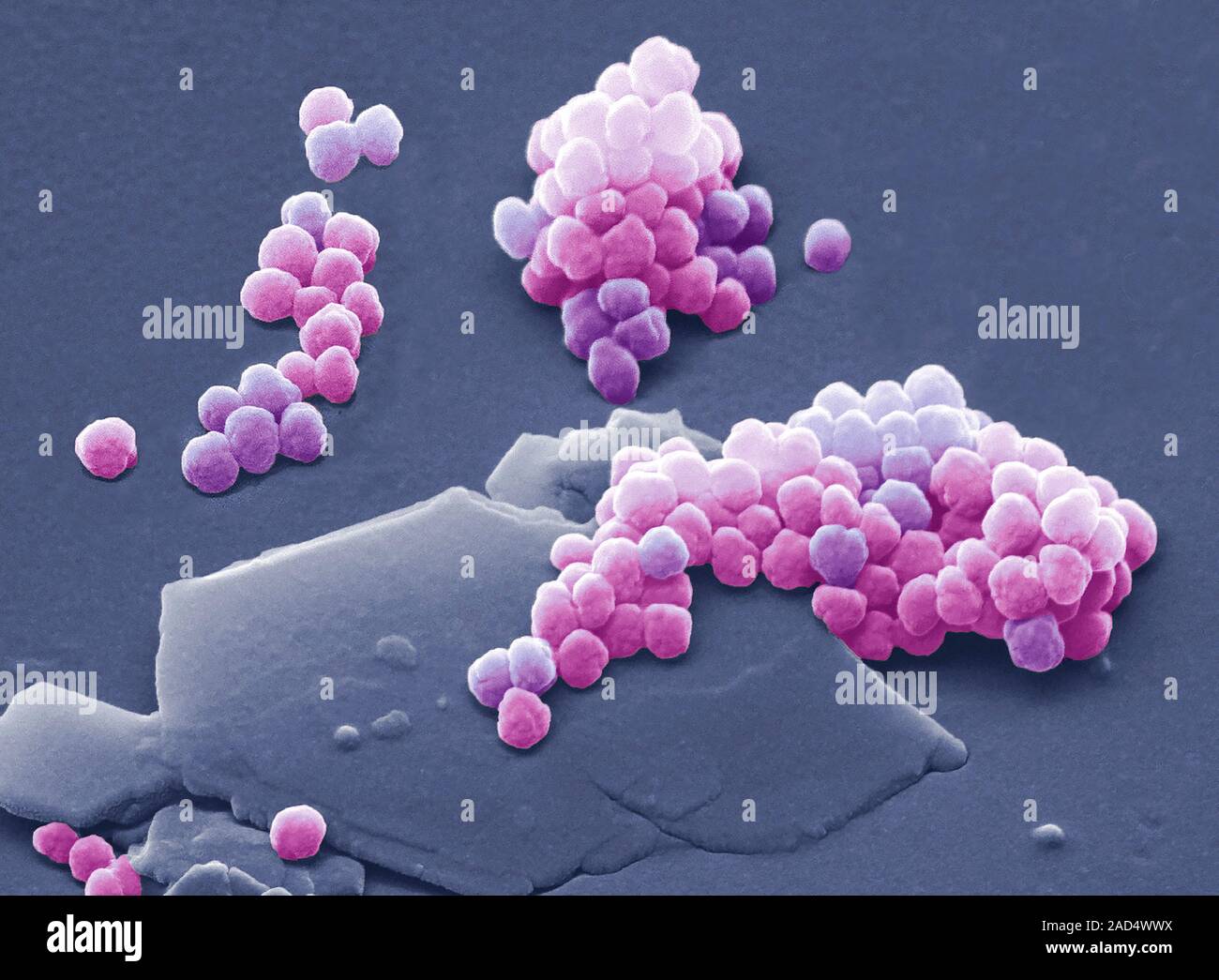 Microbeads. Coloured scanning electron micrograph (SEM) of particles ...