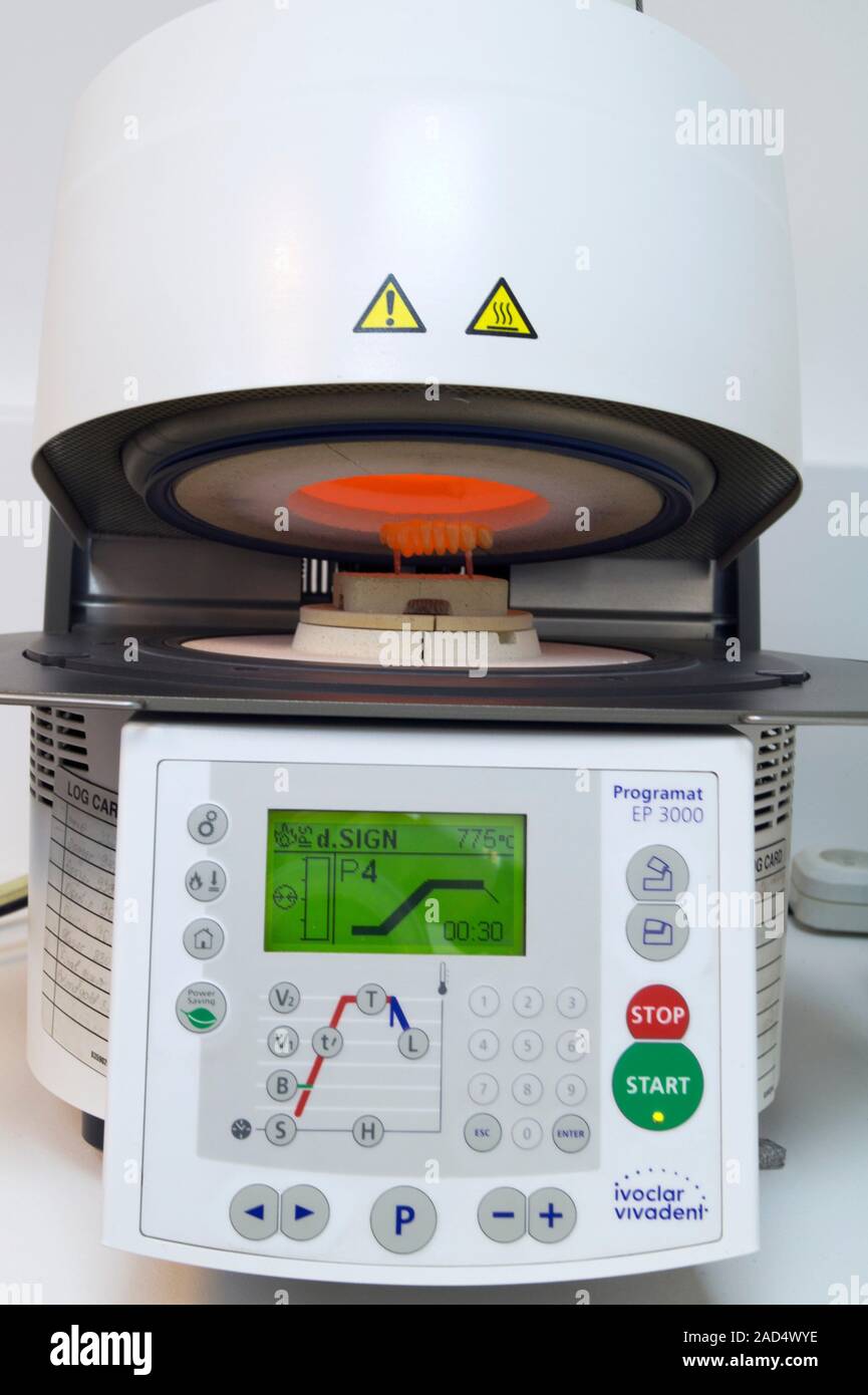 Dental bridge furnace. Furnace that is being used to create a dental ...