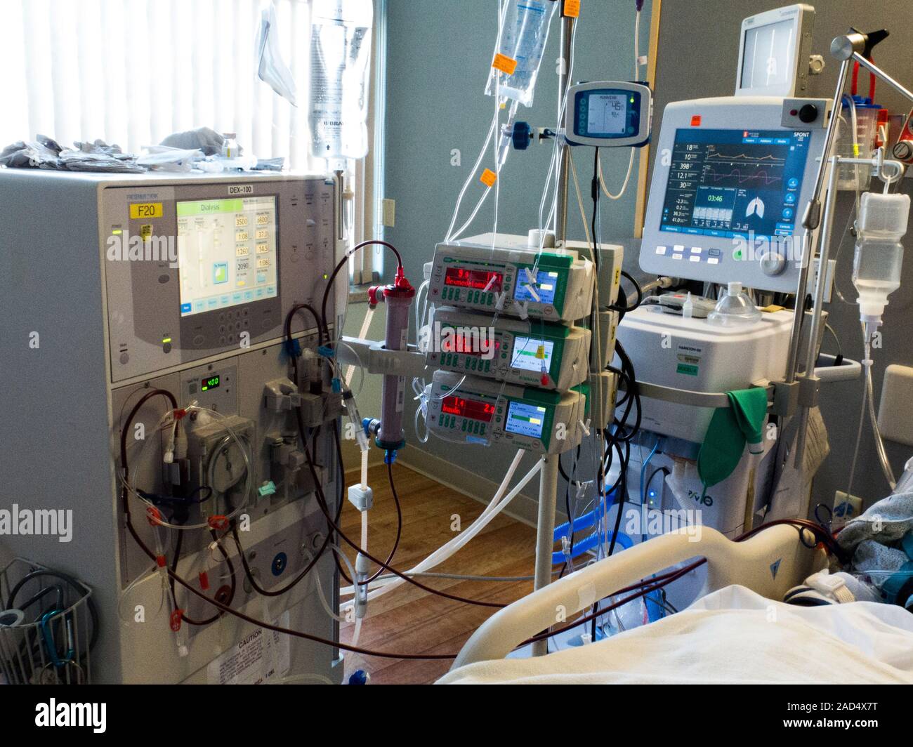 Kidney dialysis in intensive care unit. Haemodialysis machine being ...