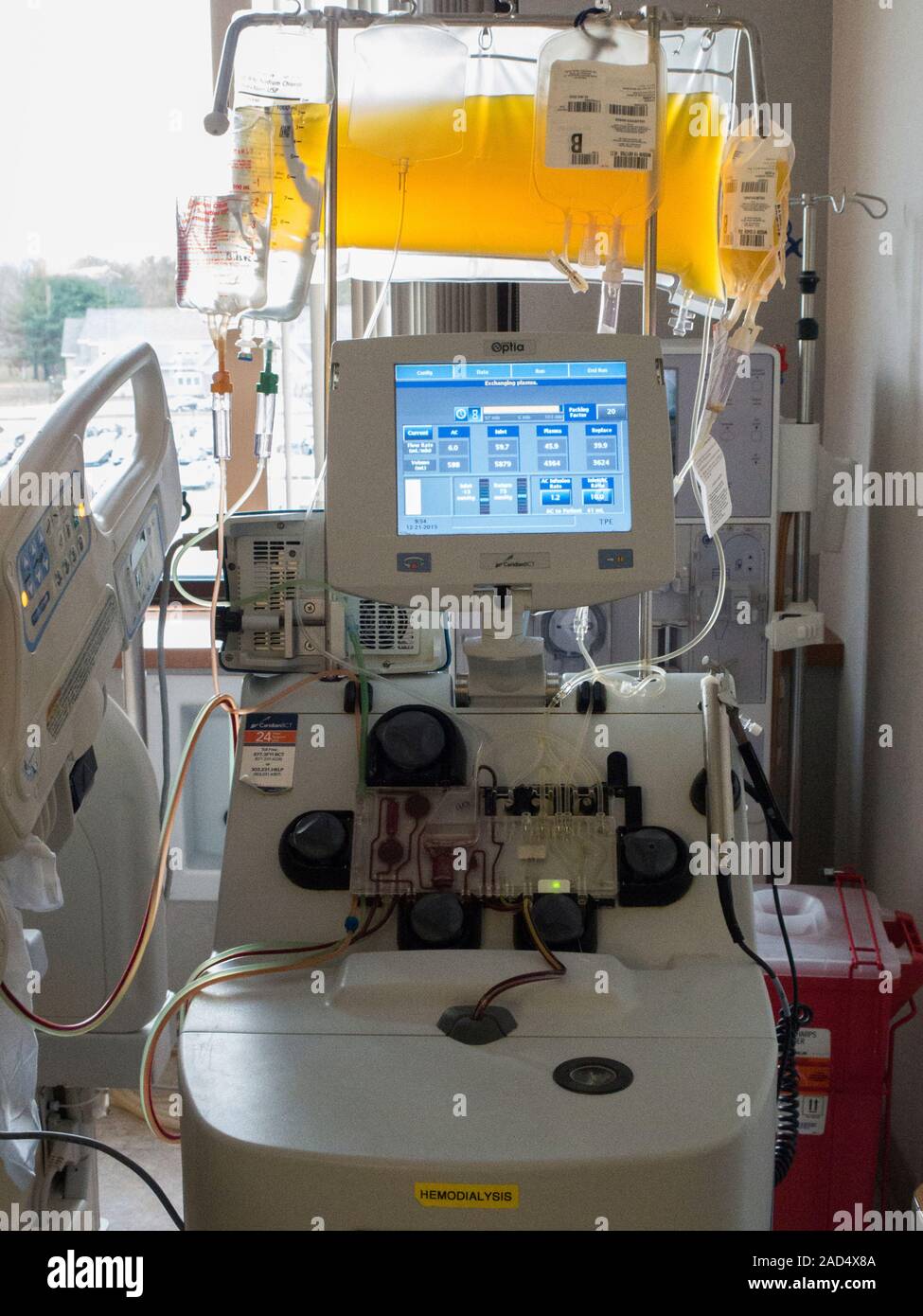 Plasmapheresis machine in use. Close-up of a plasmapheresis machine ...