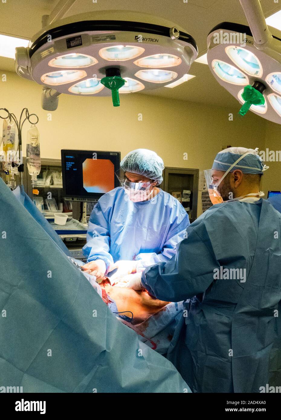 Bowel surgery in pneumoperitoneum. Surgeons performing an endoscopy ...