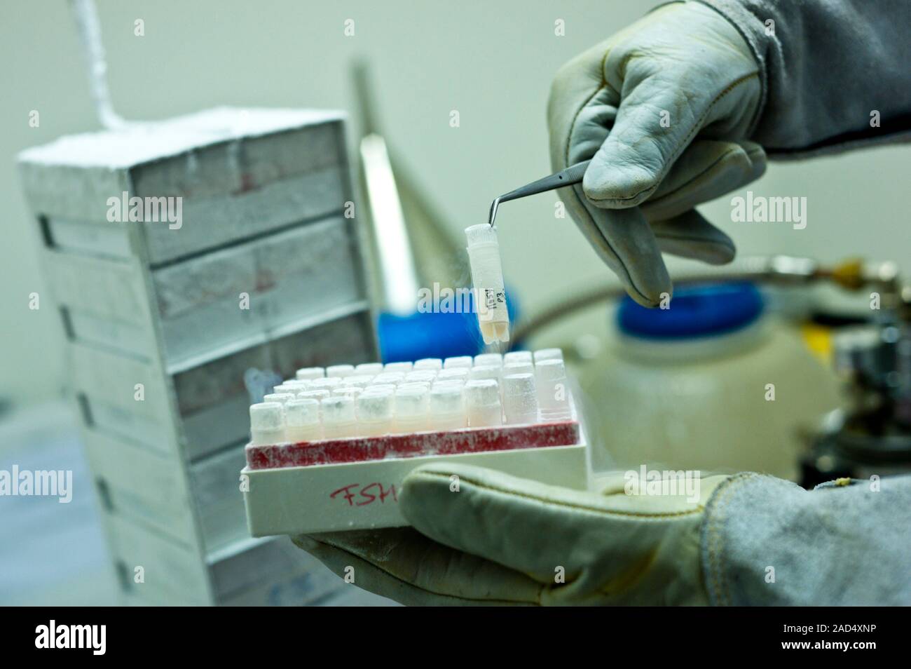 Samples taken from patients with facioscapulohumeral muscular dystrophy ...