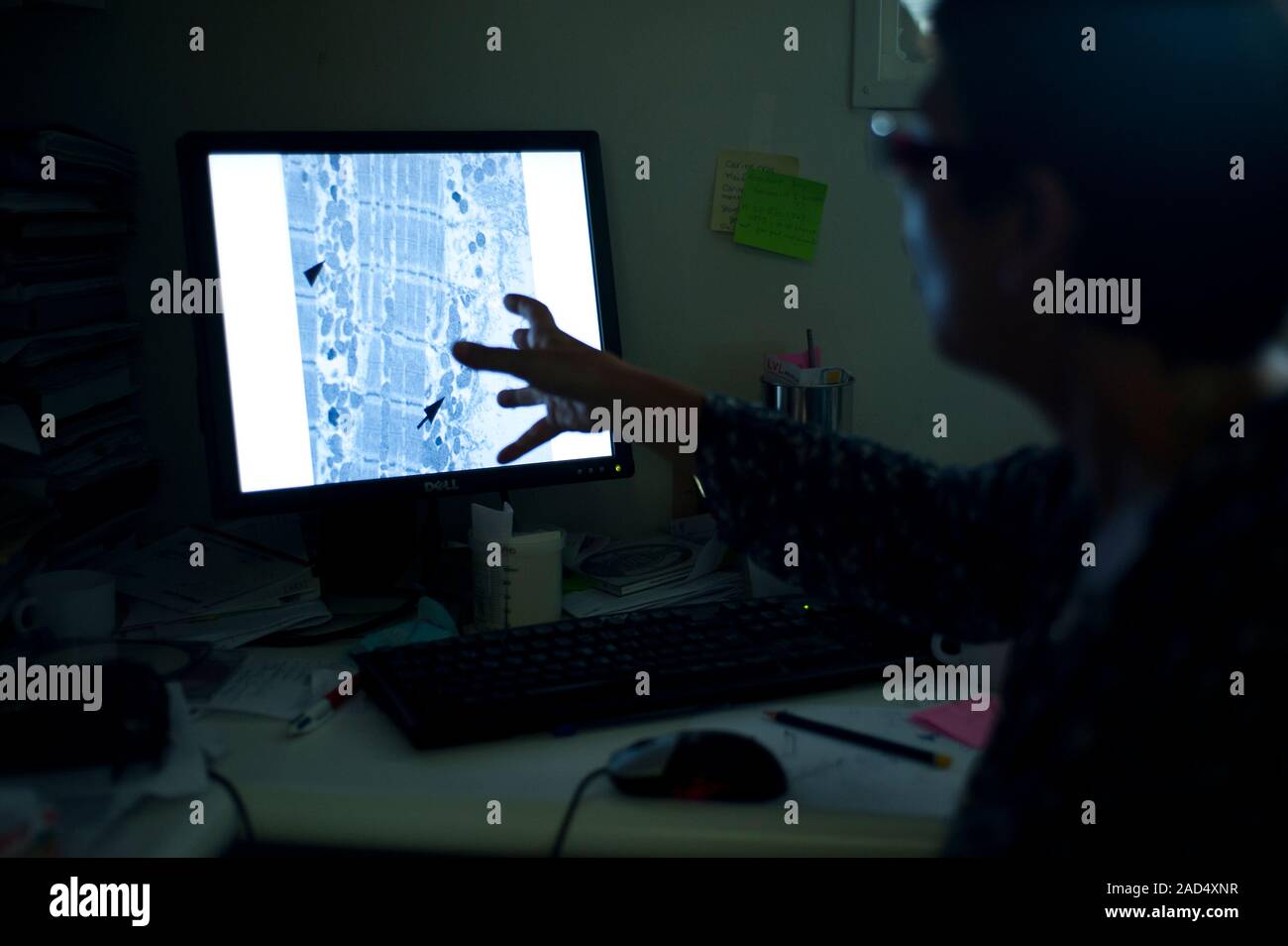 A researcher working in the field of facioscapulohumeral muscular ...