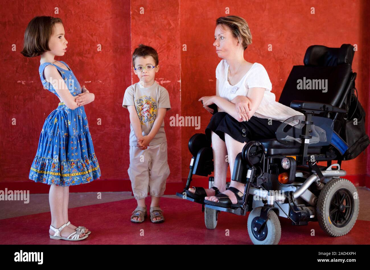 A woman with skeletal muscle wastage and lordosis (inward curvature of ...