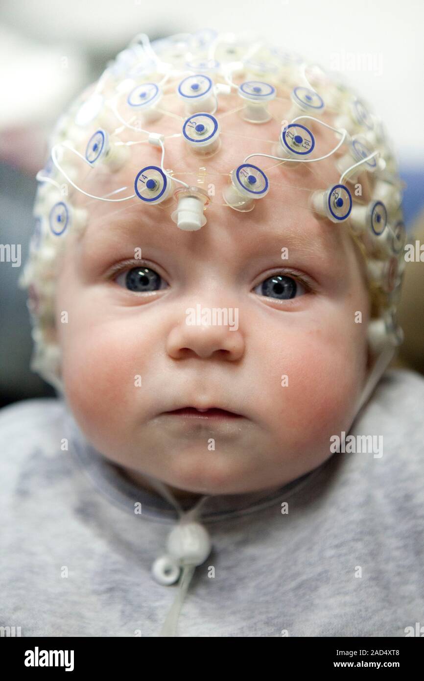 Baby electroencephalography. A baby being studied by non-invasive ...