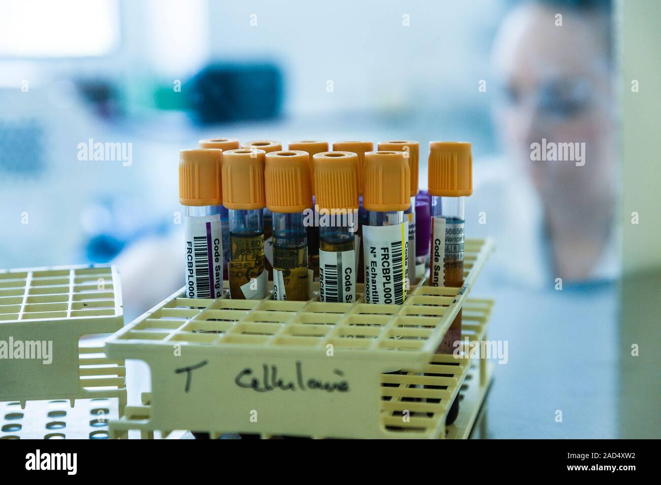 Blood products. Blood products from a biobank for umbilical cord blood ...