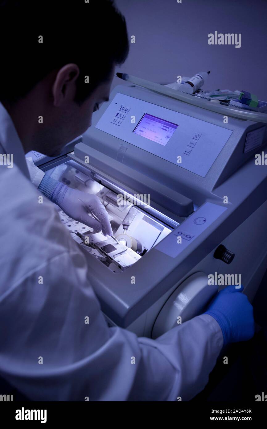 Test staining of cancerous biopsy tissue for analysis. Staining and ...