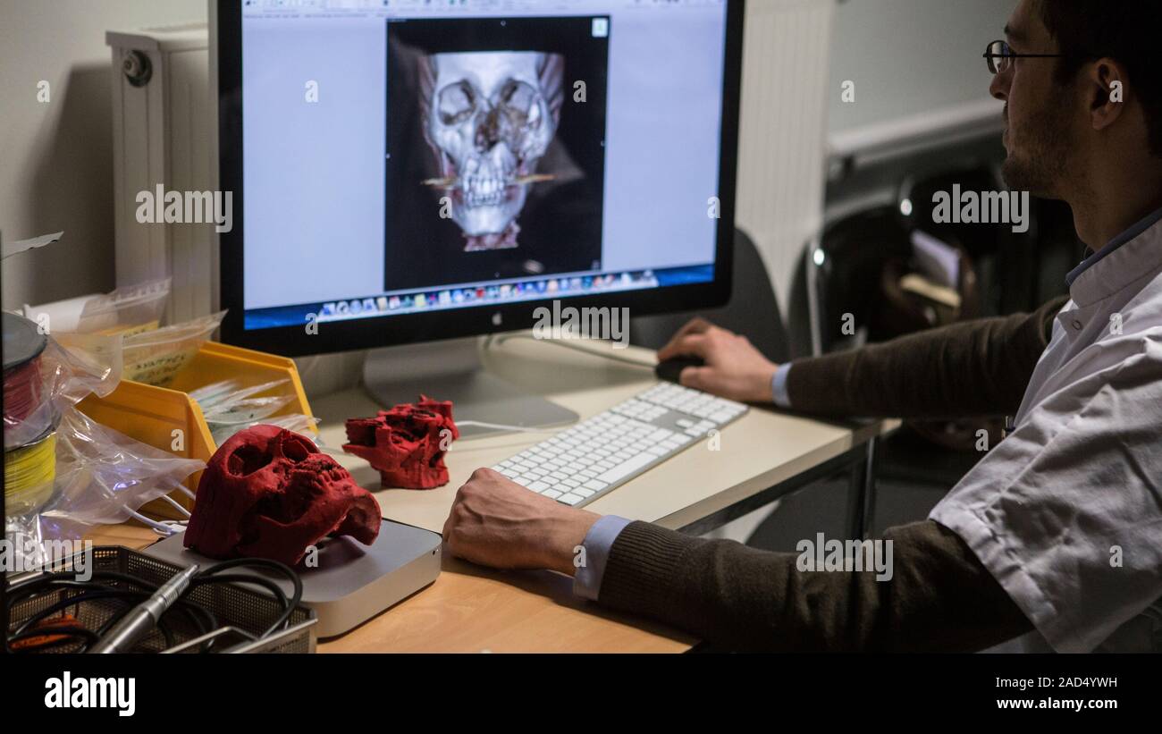 A surgeon examines a CT (computed tomography) scan and 3D print of part ...
