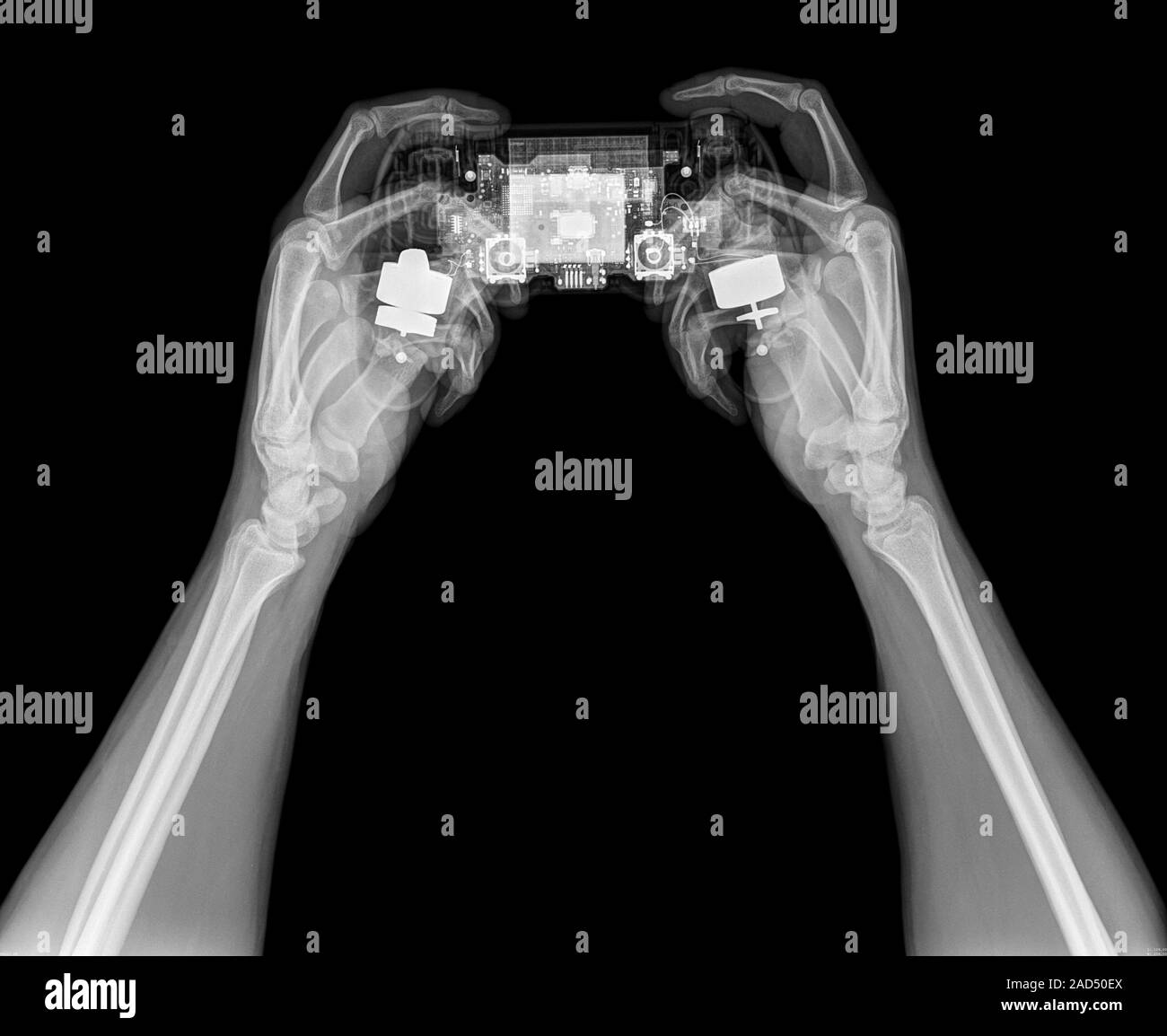 Hands holding a Playstation (PS4) controller, x-ray Stock Photo - Alamy