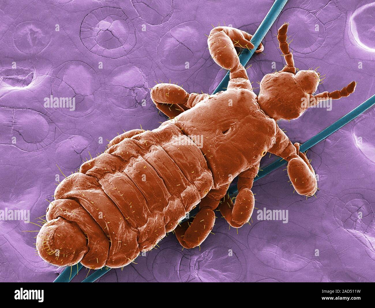 Head louse. Coloured scanning electron micrograph (SEM) of a head louse ...