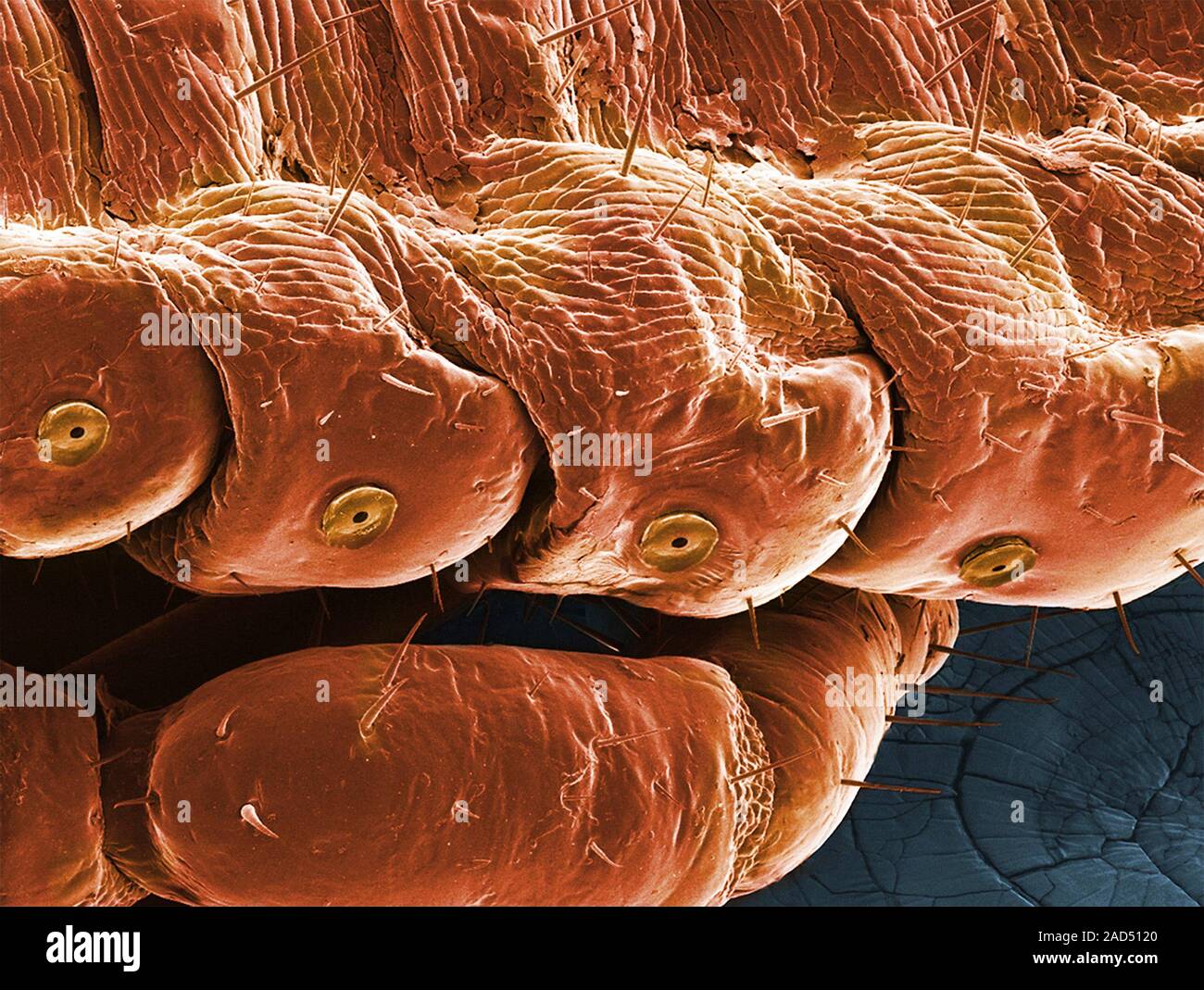 Head louse spiracles. Coloured scanning electron micrograph (SEM) of ...