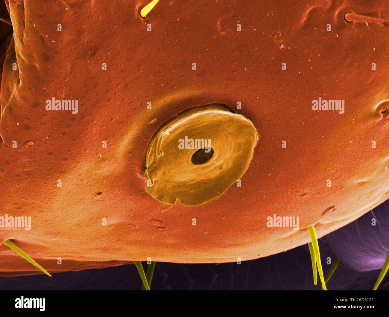Head louse. Coloured scanning electron micrograph (SEM) of a spiracle ...