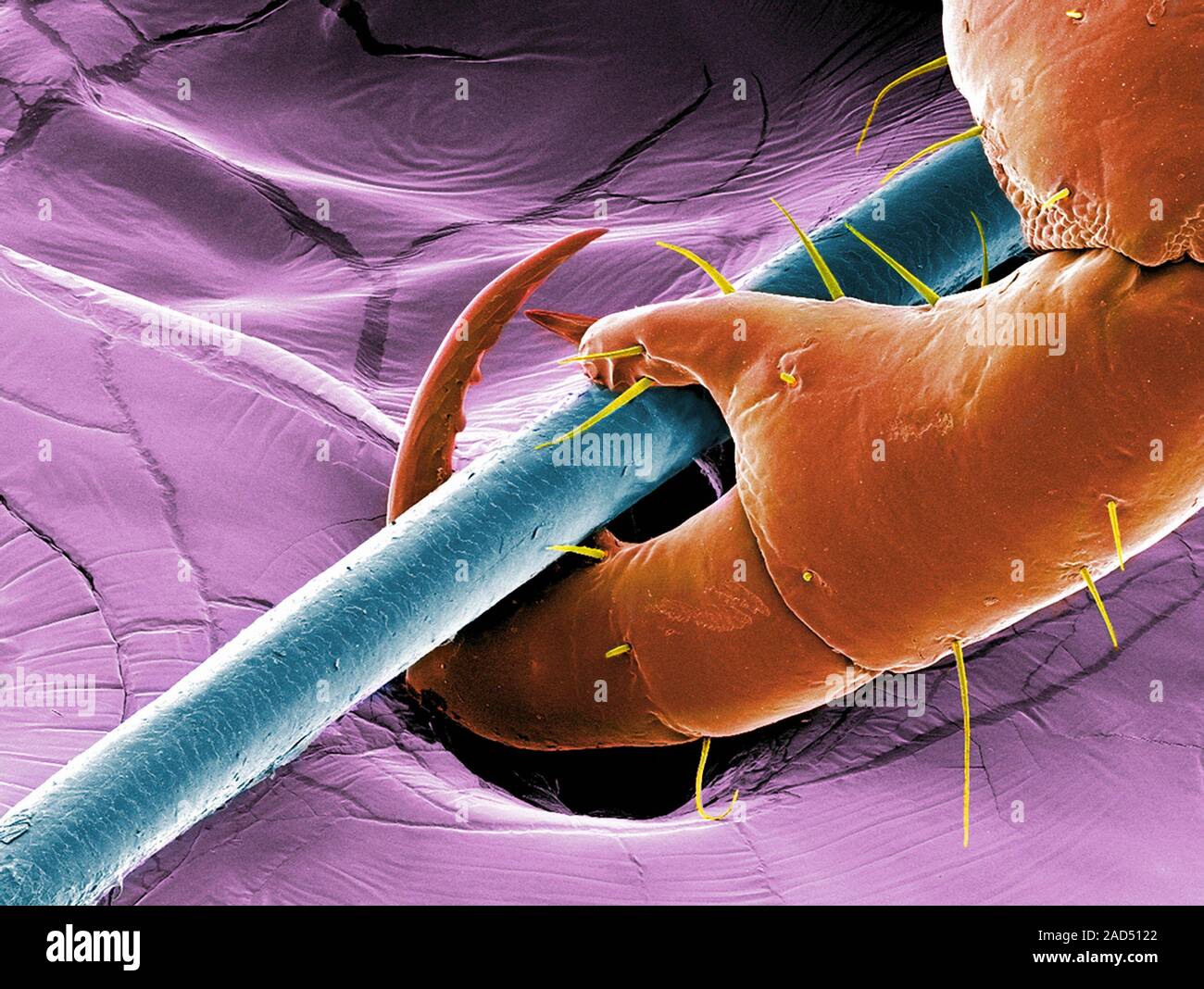 Head louse claw. Coloured scanning electron micrograph (SEM) of the ...