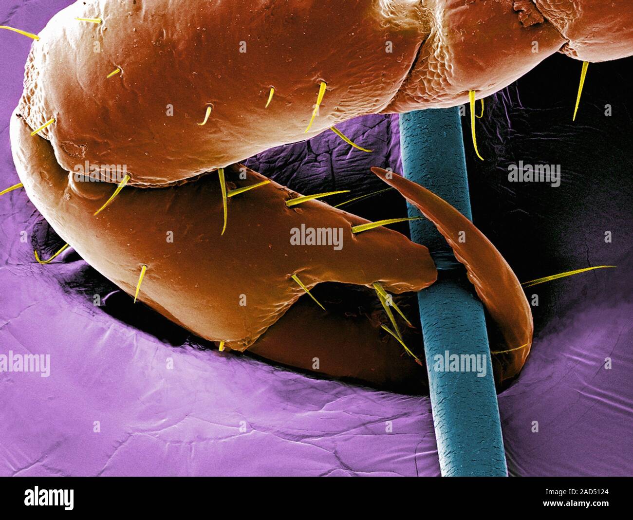 Head louse claw. Coloured scanning electron micrograph (SEM) of the ...