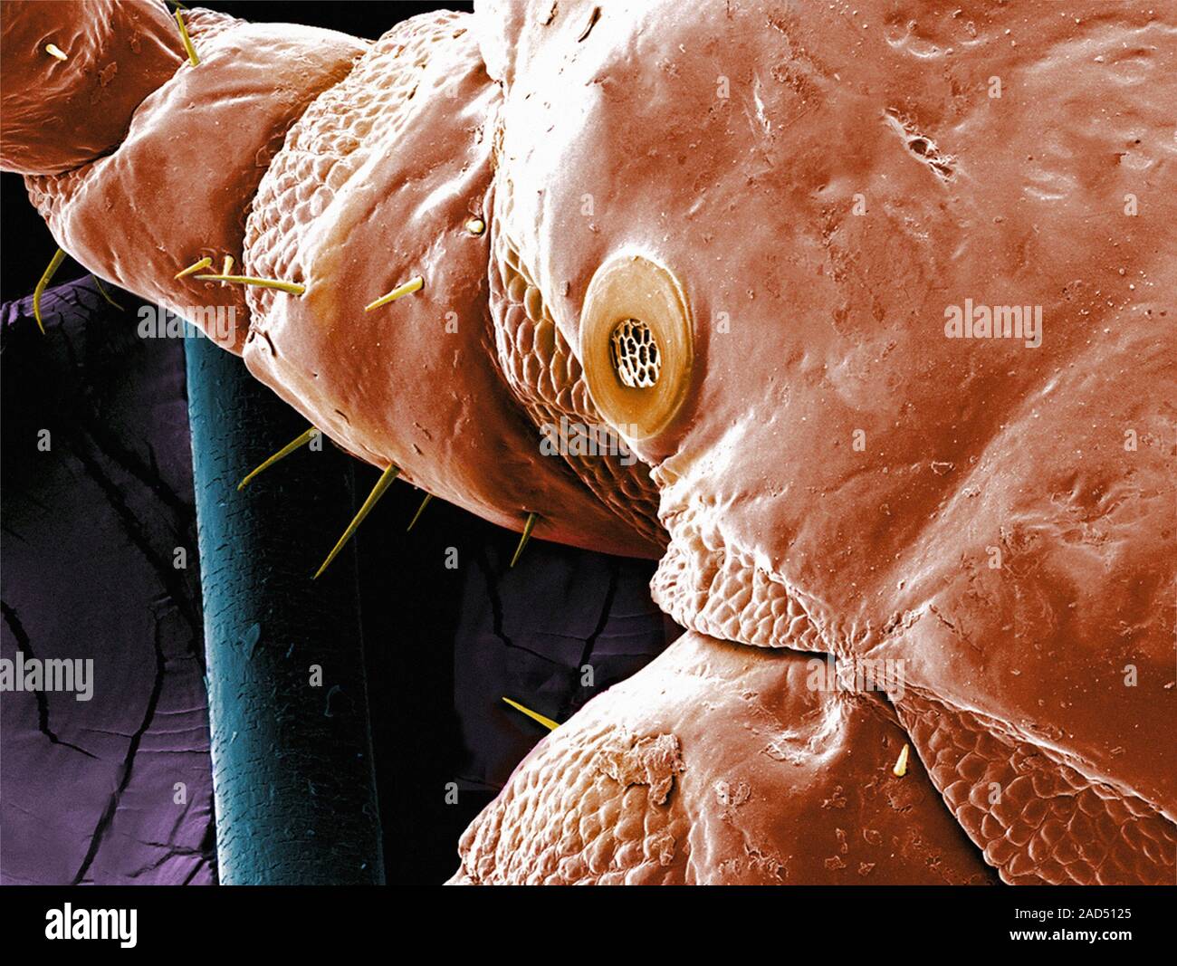 Head louse spiracle. Coloured scanning electron micrograph (SEM) of a ...