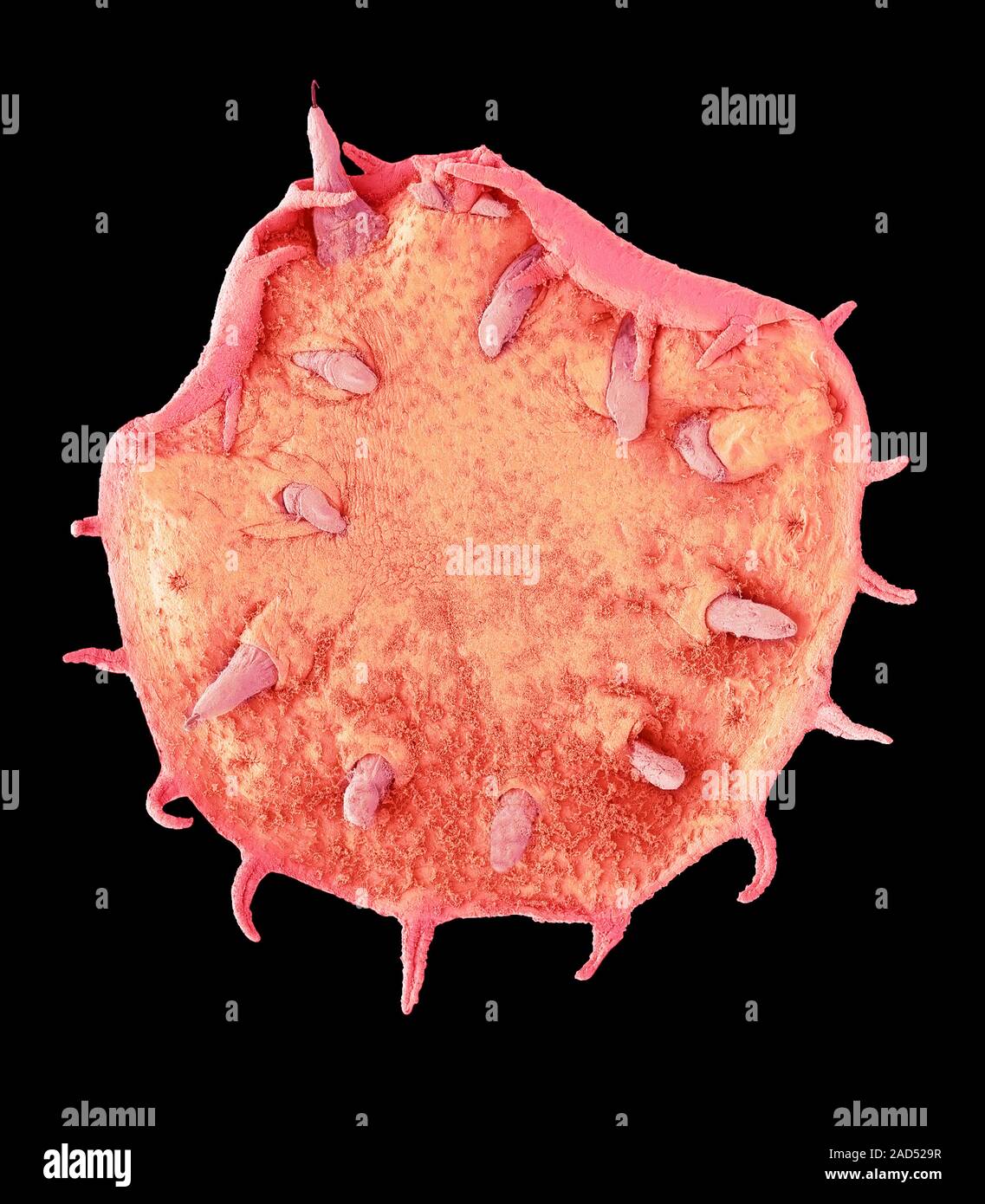 Myzostomid worm. Scanning electron micrograph (SEM) of the under ...