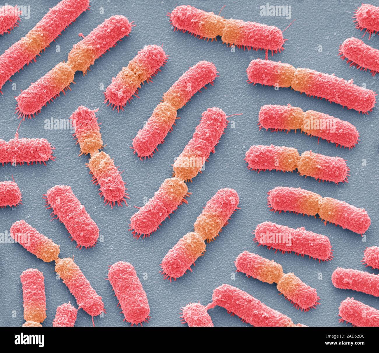 Bacillus megaterium bacterial colony, coloured scanning electron ... Bacillus megaterium bacterial colony, coloured scanning electron ...