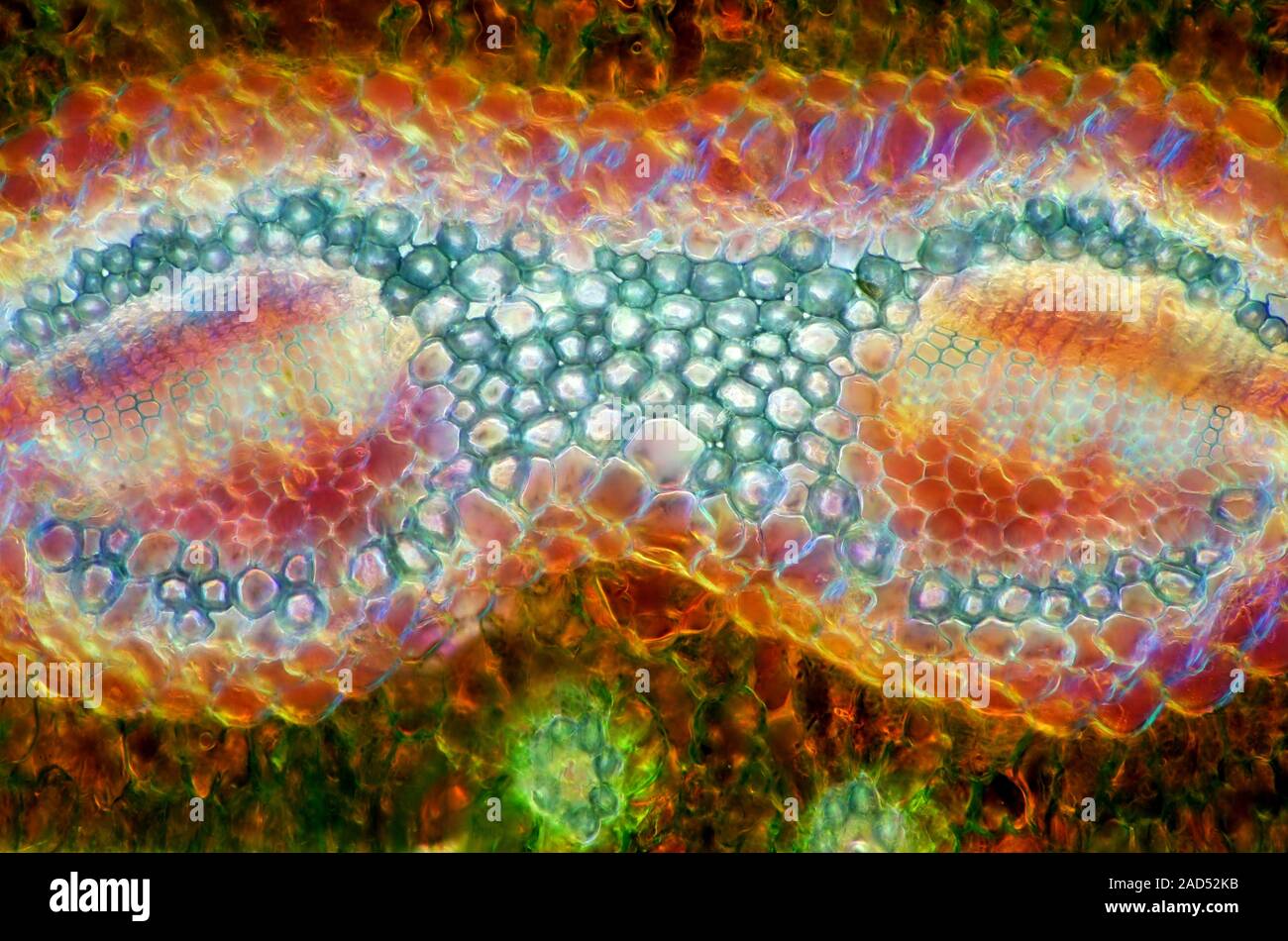 Pine needle. Darkfield illuminated polarised light micrograph of a ...