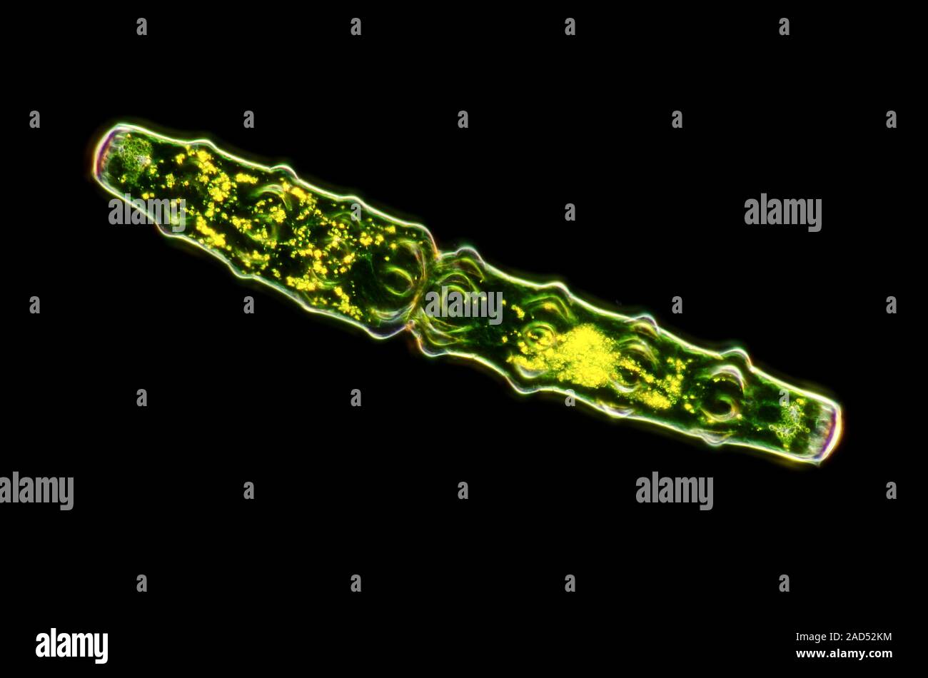 Desmid. Darkfield illuminated polarised light micrograph of the desmid ...