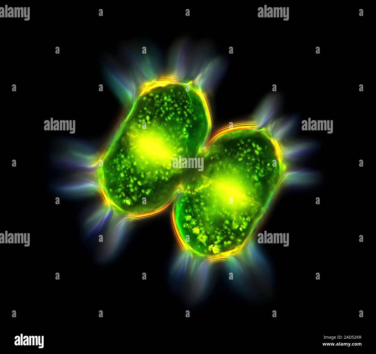 Desmid. Darkfield illuminated polarised light micrograph of the desmid ...