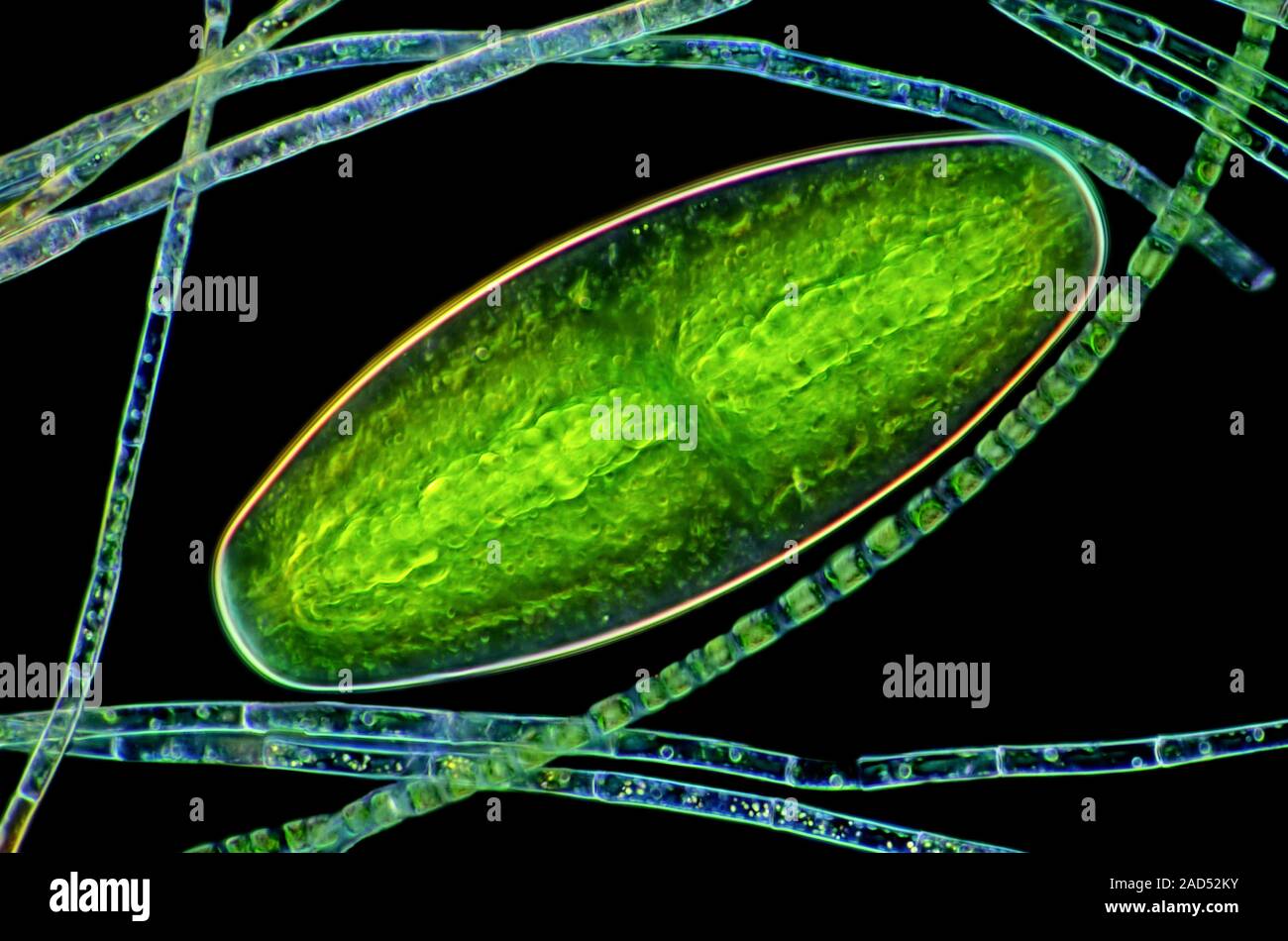 Netrium desmid and green alga. Darkfield illuminated polarised light ...