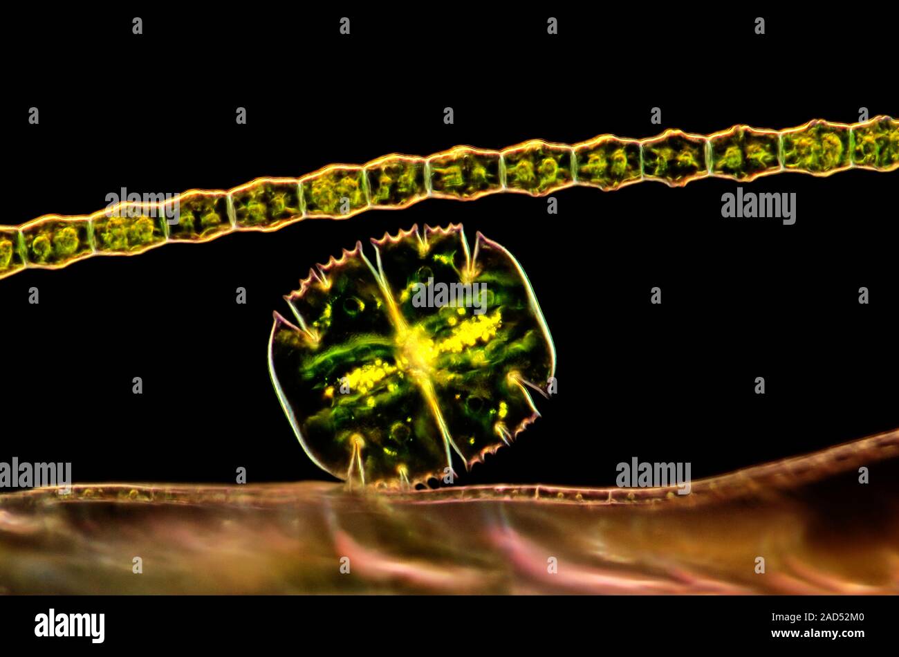 Desmid. Darkfield illuminated polarised light micrograph of the desmids ...