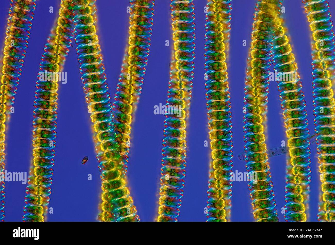 Desmid. Polarised light micrograph of the filamentous desmid Desmidium ...
