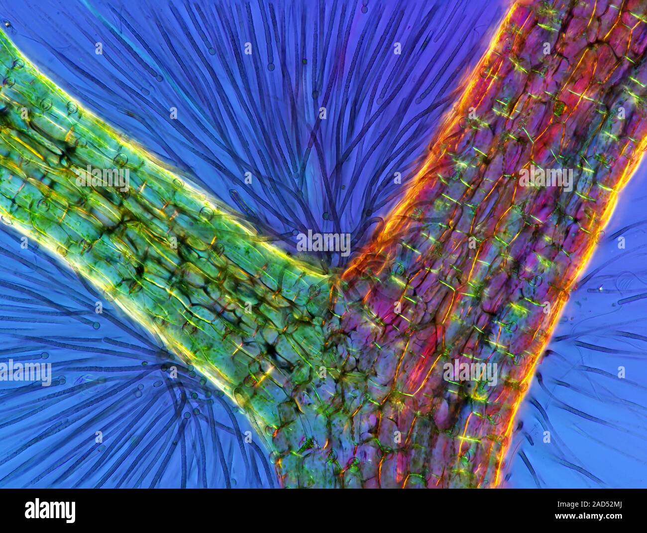 Rivularia cyanobacteria on watermilfoil plant. Polarised light ...
