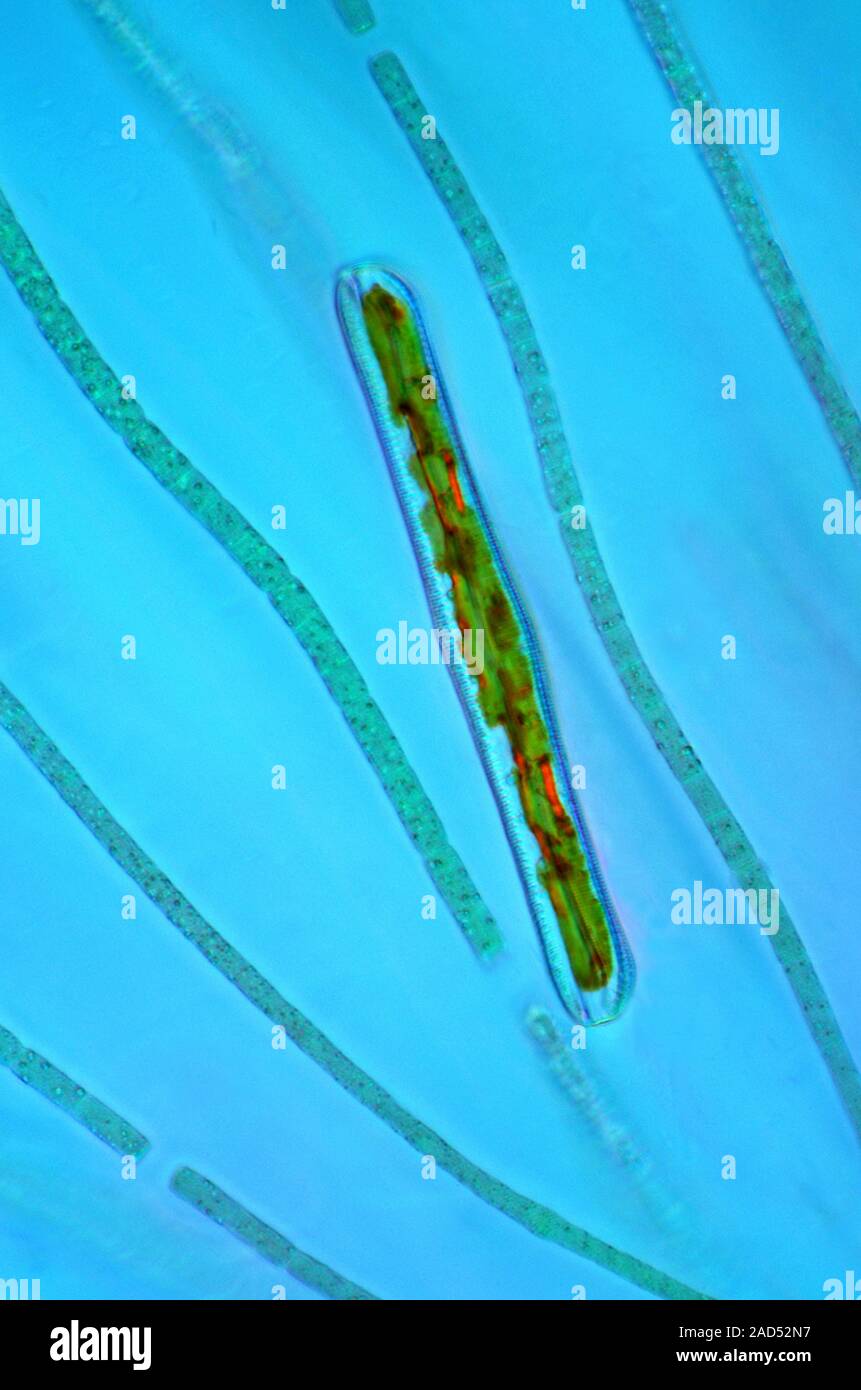 Cyanobacteria and diatom. Polarised light micrograph of filamentous ...