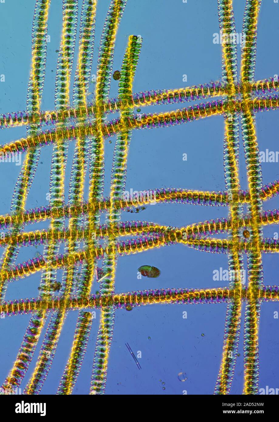 Desmid. Polarised light micrograph of the filamentous desmid Desmidium ...