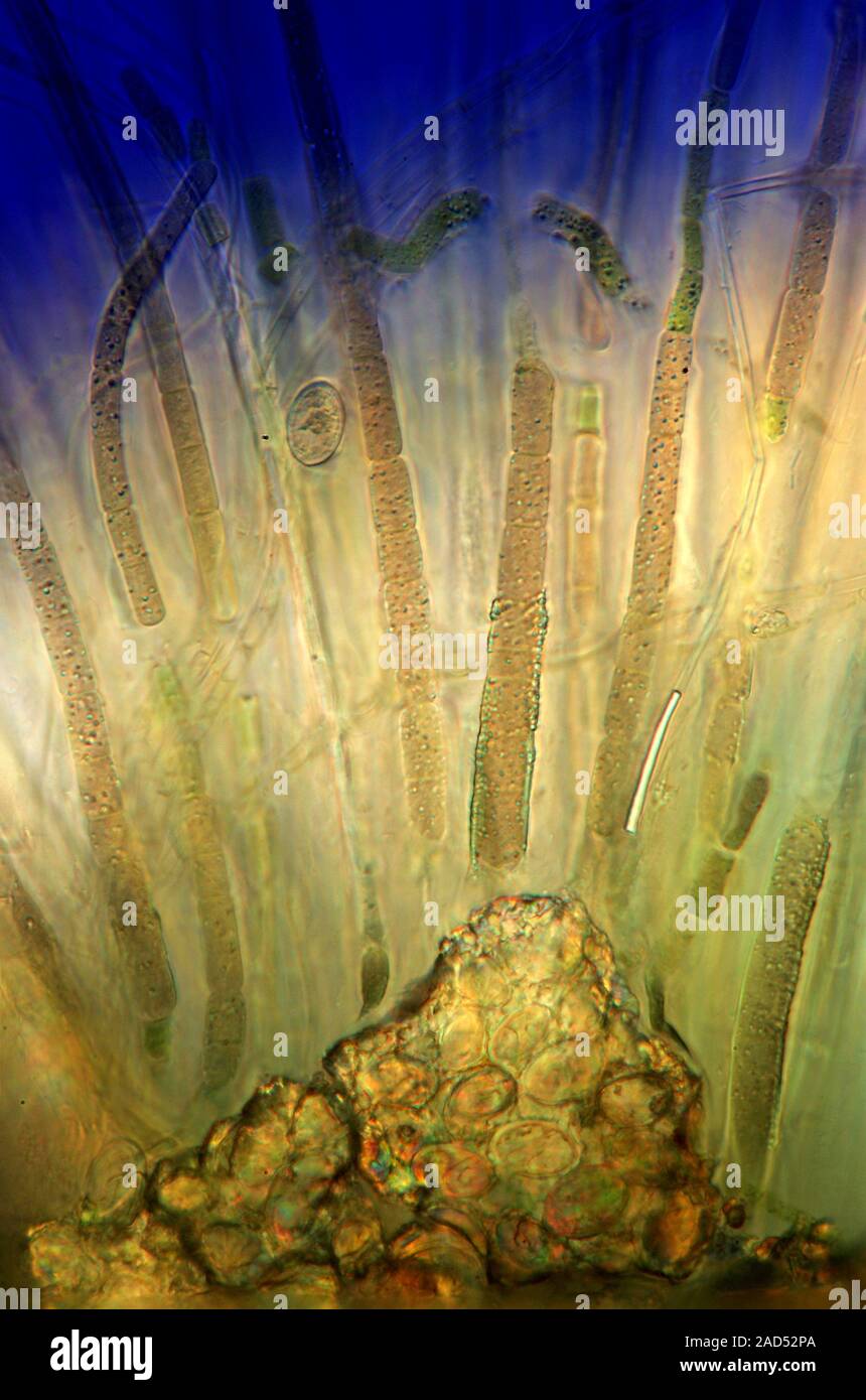 Rivularia cyanobacteria. Polarised light micrograph of a colony of ...