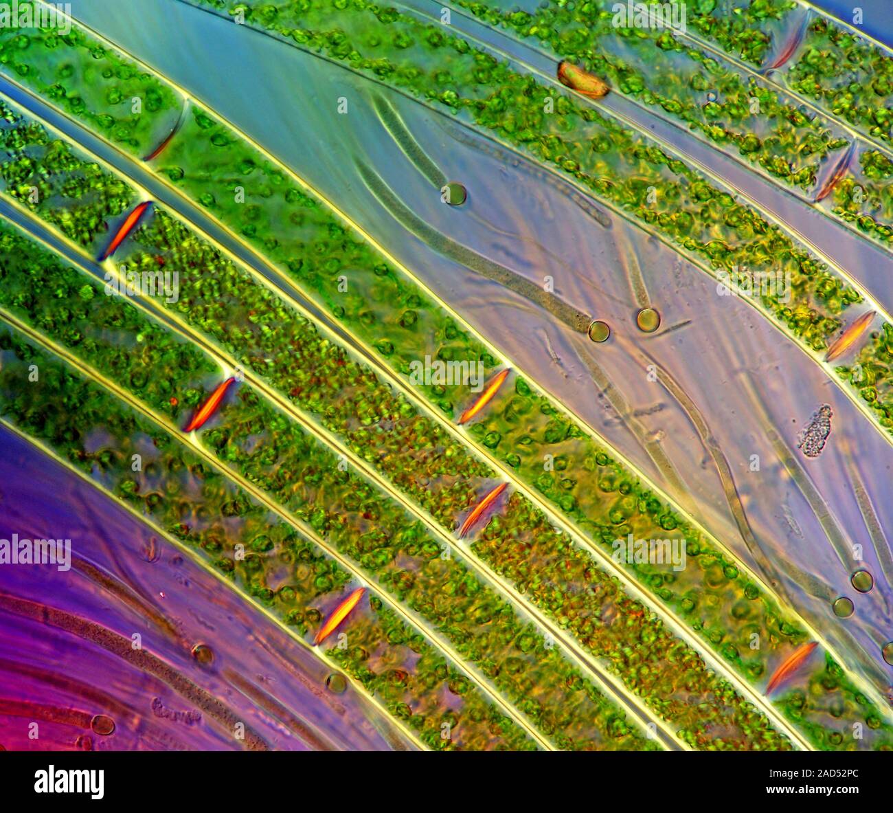 Spirogyra algae and cyanobacteria. Polarised light micrograph of ...