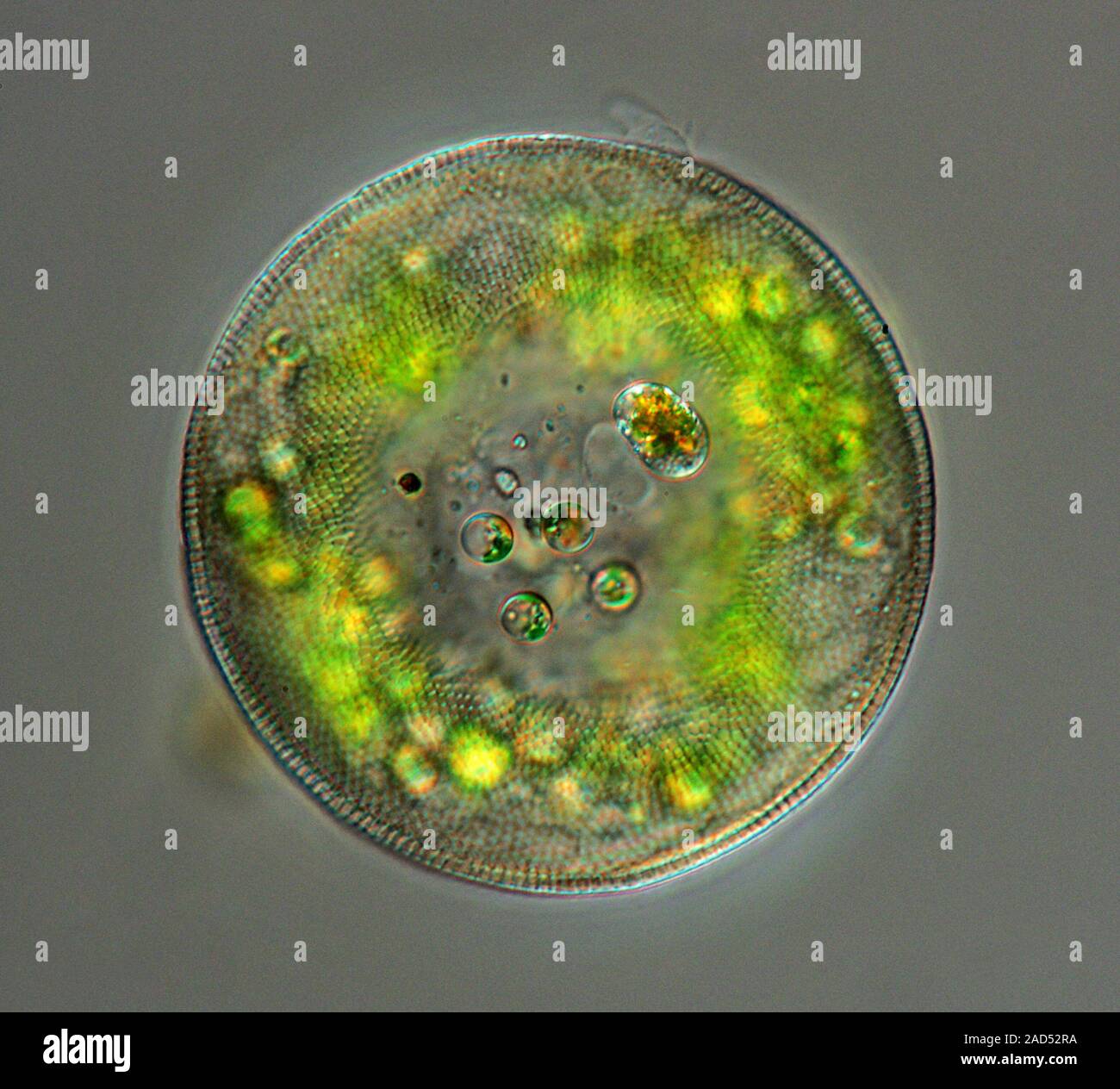 Testate amoeba. Polarised light micrograph of an Arcella sp. testate ...