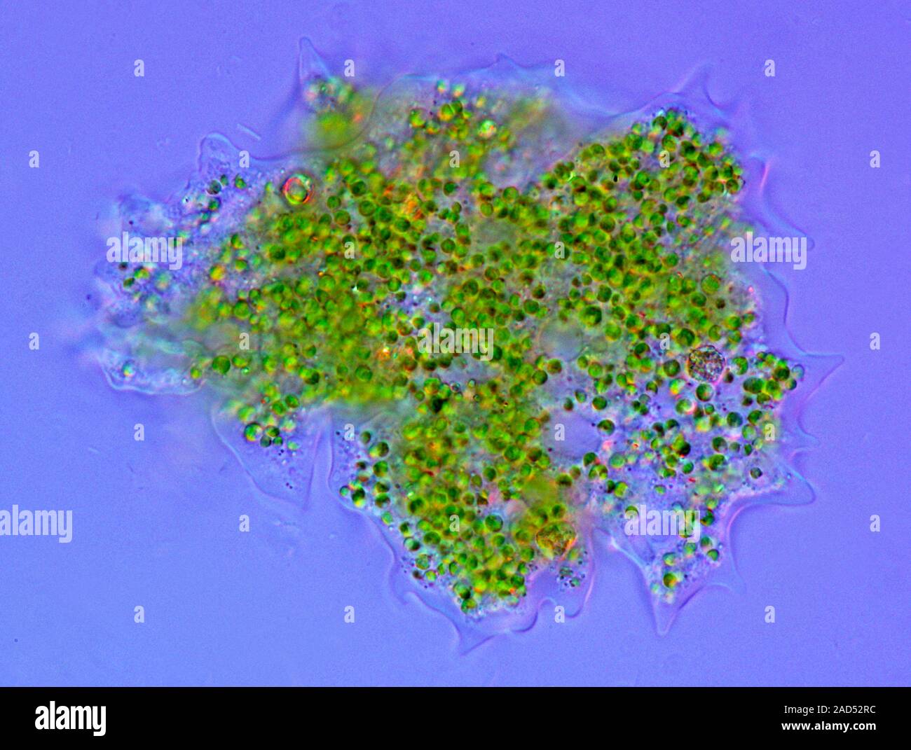 Amoeba. Polarised light micrograph of an Amoeba sp. protozoan with ...